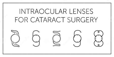 Types of Intraocular Lenses Stock Illustration - Illustration of ...