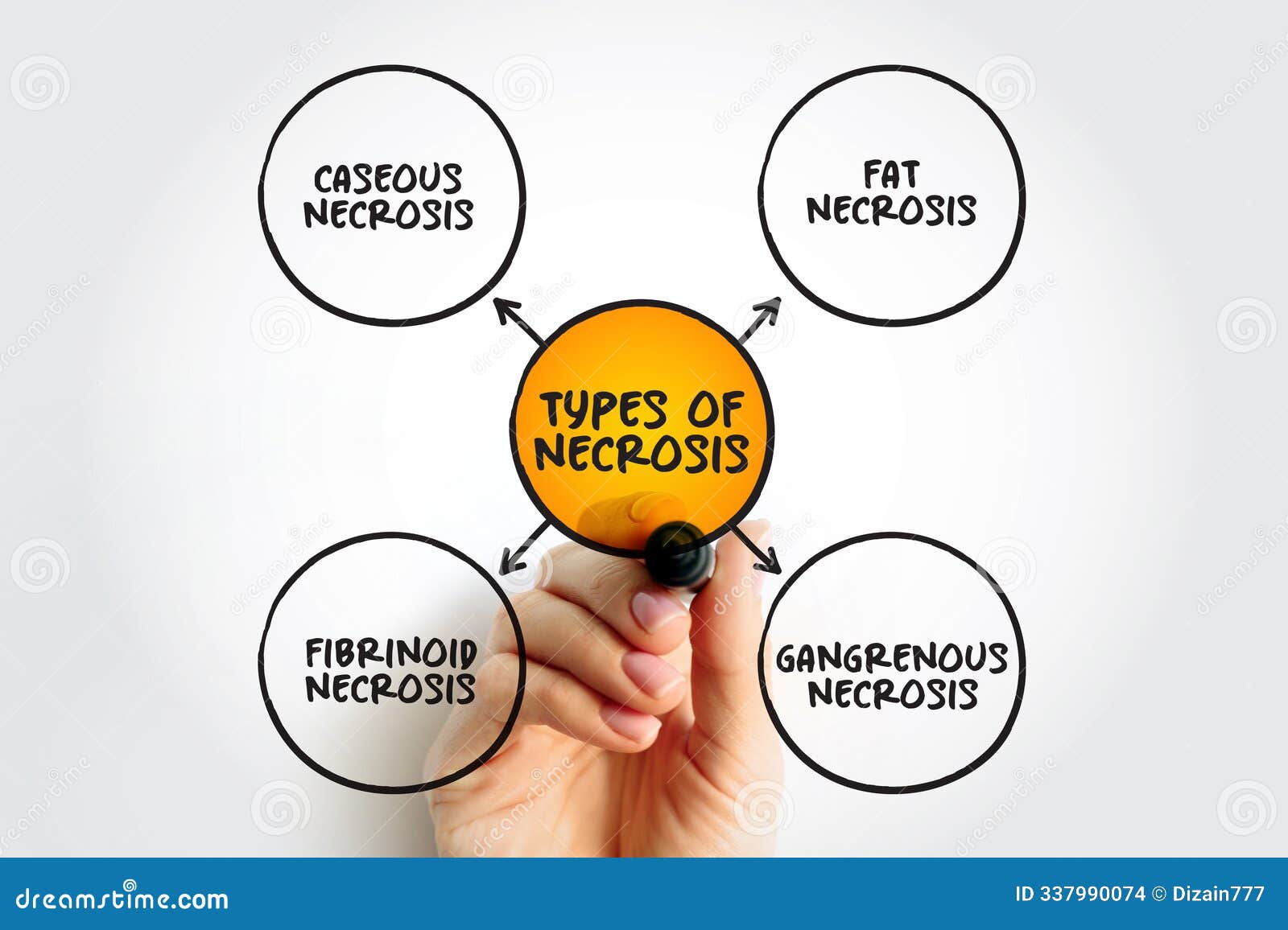 Types Of Necrosis (death Of Body Tissue) Mind Map Text Concept For ...