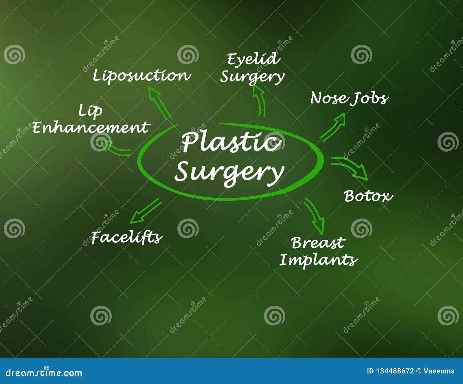 Types of Plastic Surgery stock illustration. Illustration of aesthetic ... Types of Plastic Surgery stock illustration. Illustration of aesthetic ...