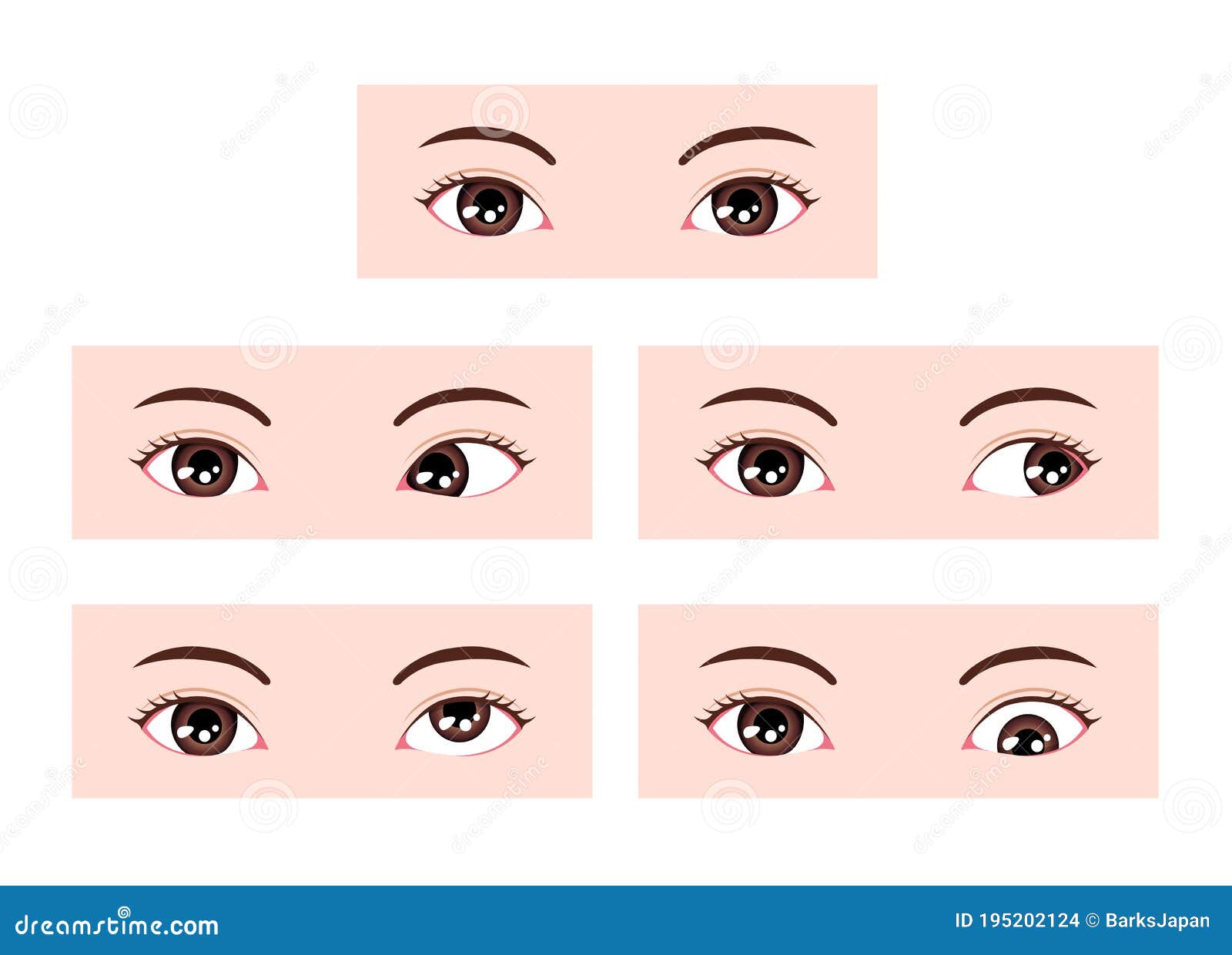 Strabismus Types. Hypotropia, Hypertropia, Exotropia, Esotropia. Human ... Strabismus Types. Hypotropia, Hypertropia, Exotropia, Esotropia. Human ...