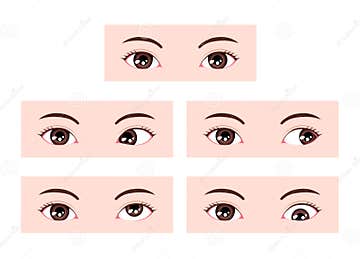 Types of Strabismus Vector Illustration Stock Vector - Illustration of ...
