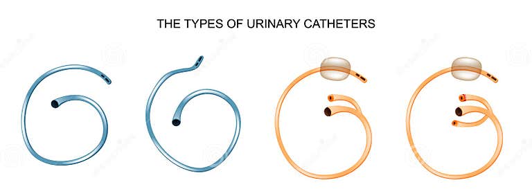 The Types of Urinary Catheters Stock Vector - Illustration of sample ...