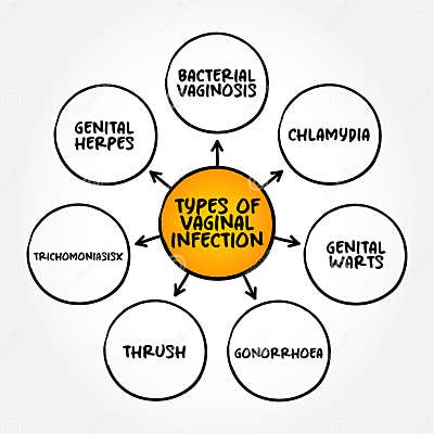 Types of Vaginal Infection Mind Map, Text Concept for Presentations and ...