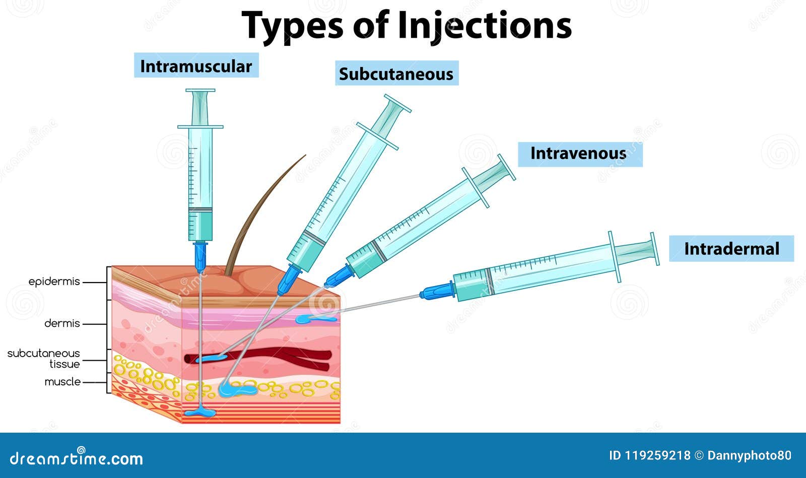 Types Van Injecties Op Witte Achtergrond Vector Illustratie ...