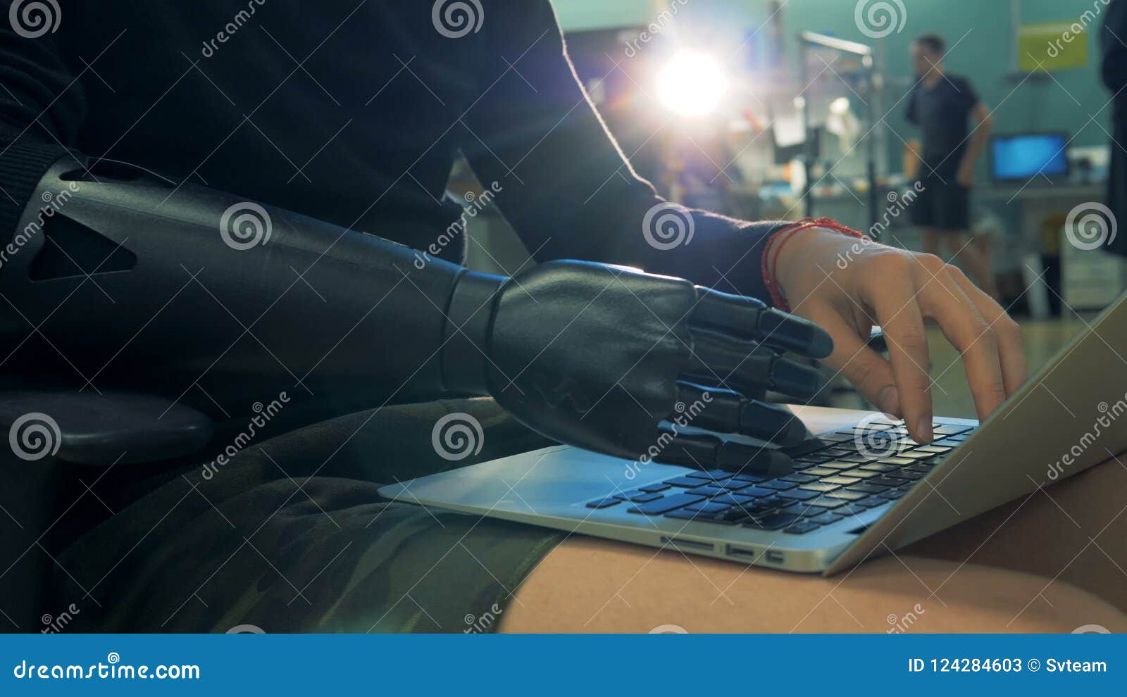 Typing Process Performed by a Person with a Prosthetic Hand Stock Video ...