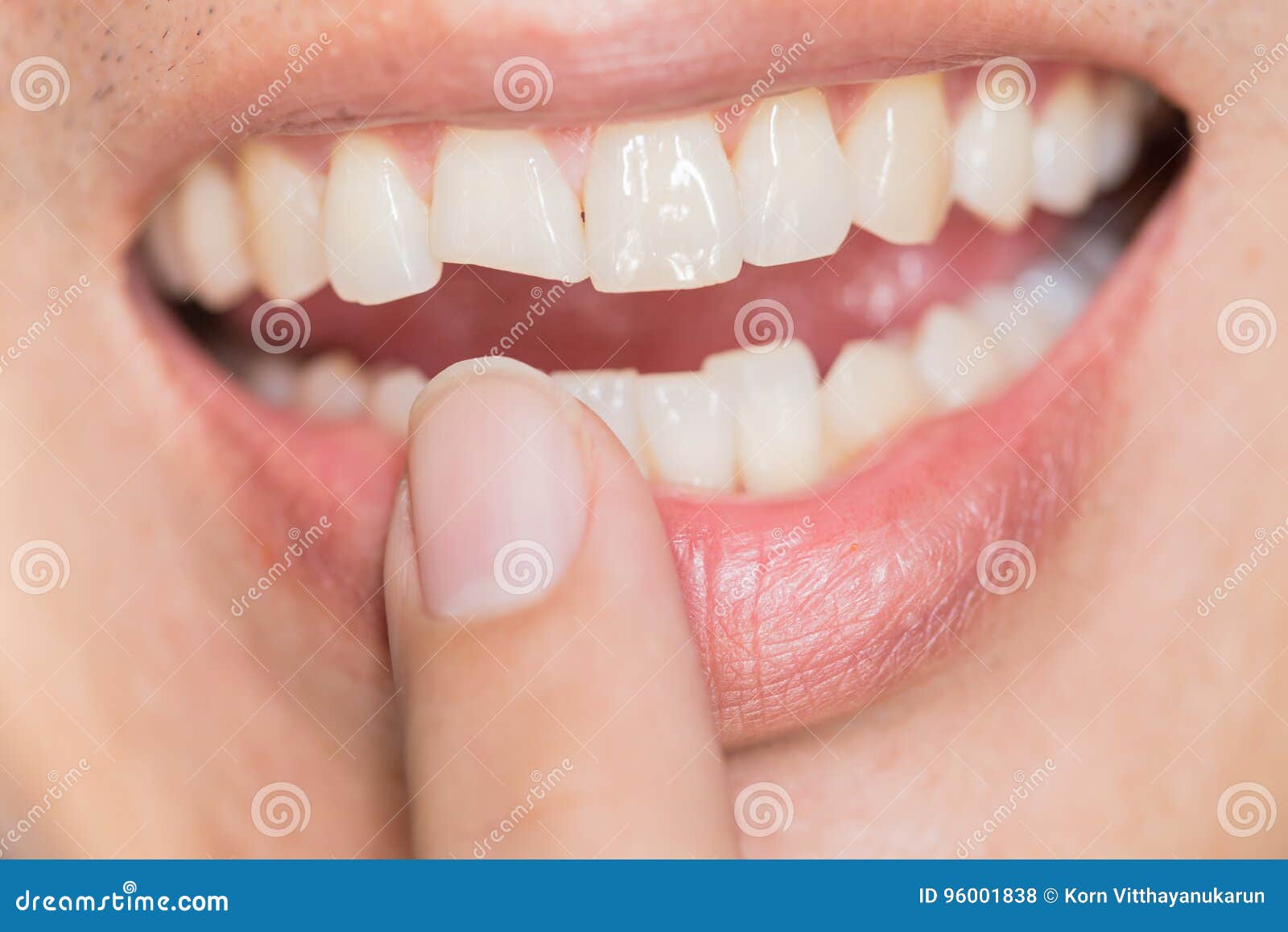4,955 Ugly Smile Stock Photos - Free & Royalty-Free Stock Photos from ...