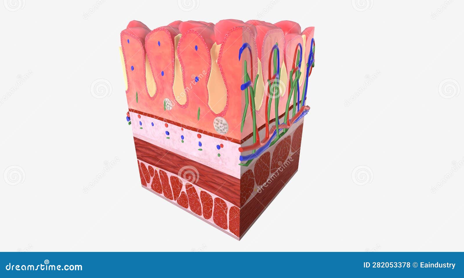 Ulcerative Colitis, Effects on Colon Tissue Stock Illustration ...