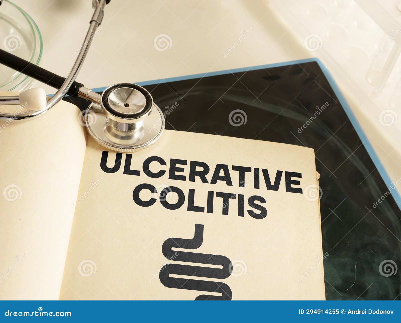 Ulcerative Colitis is Shown Using the Text and Picture of Intestine in ...