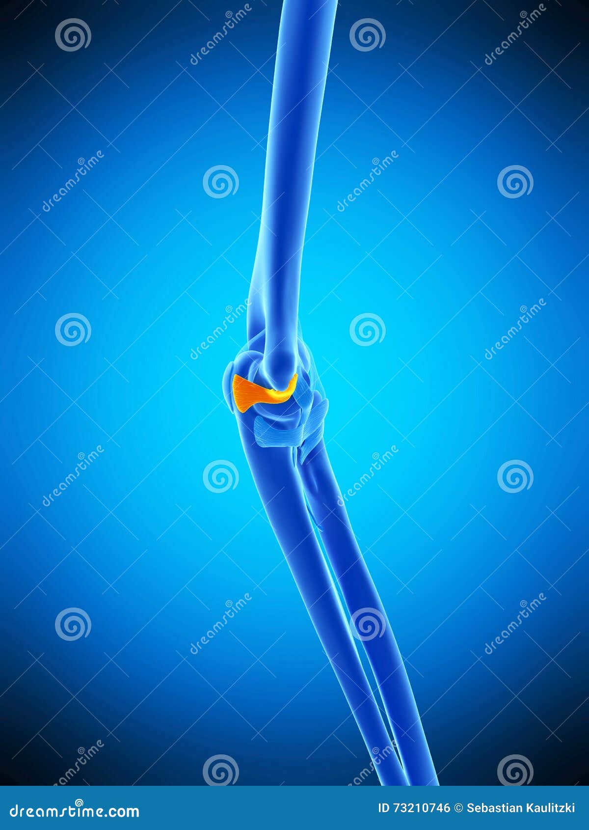 Ulnar Collateral Ligament Or UCL With Anatomical Structure Outline ...