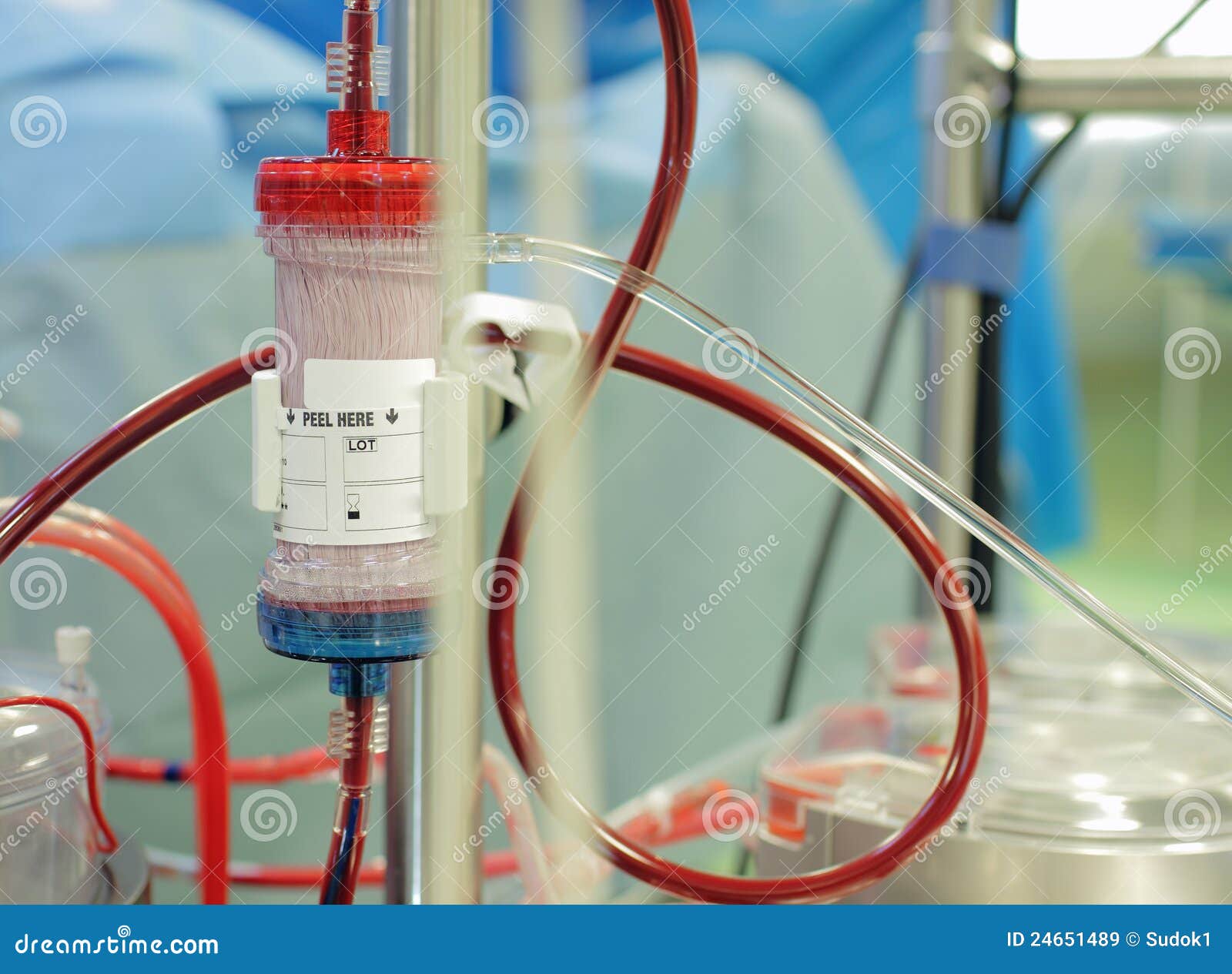 Ultrafiltration during Cardiopulmonary Bypass Stock Image - Image of ...