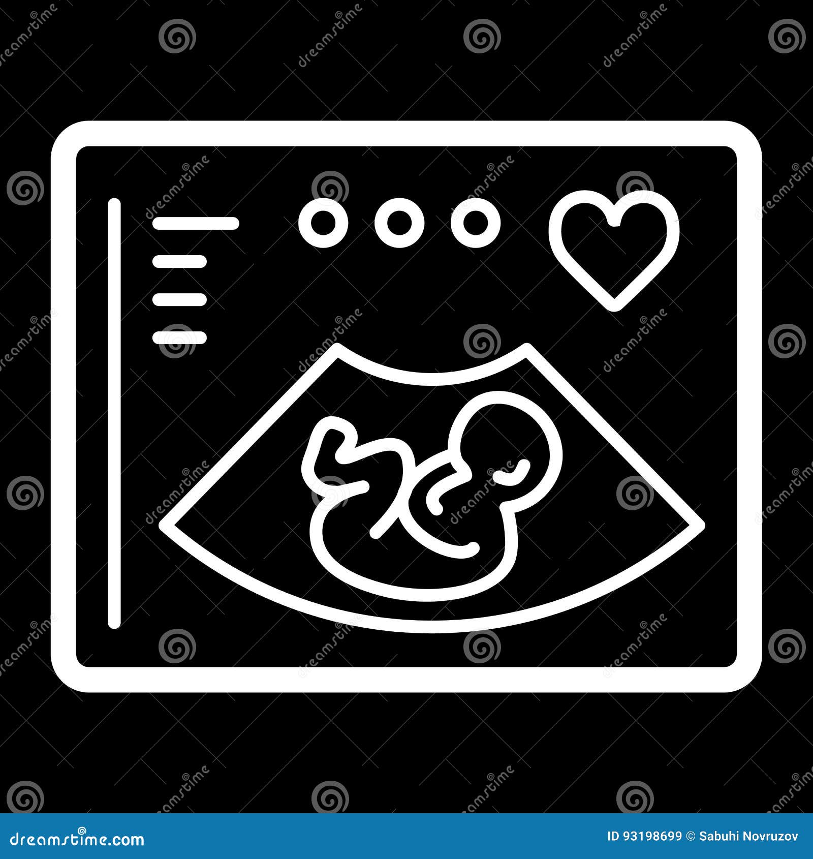 Ultrasonography Vector Icon On White Background. Flat Vector ...