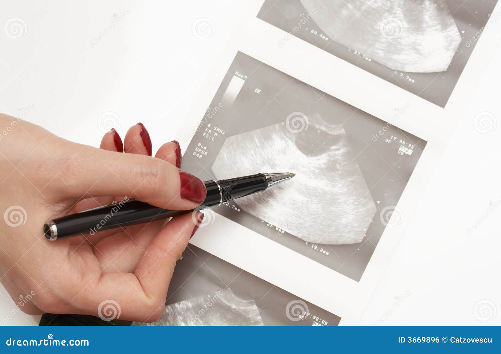 Ultrasound analysis stock photo. Image of care, sick, health - 3669896