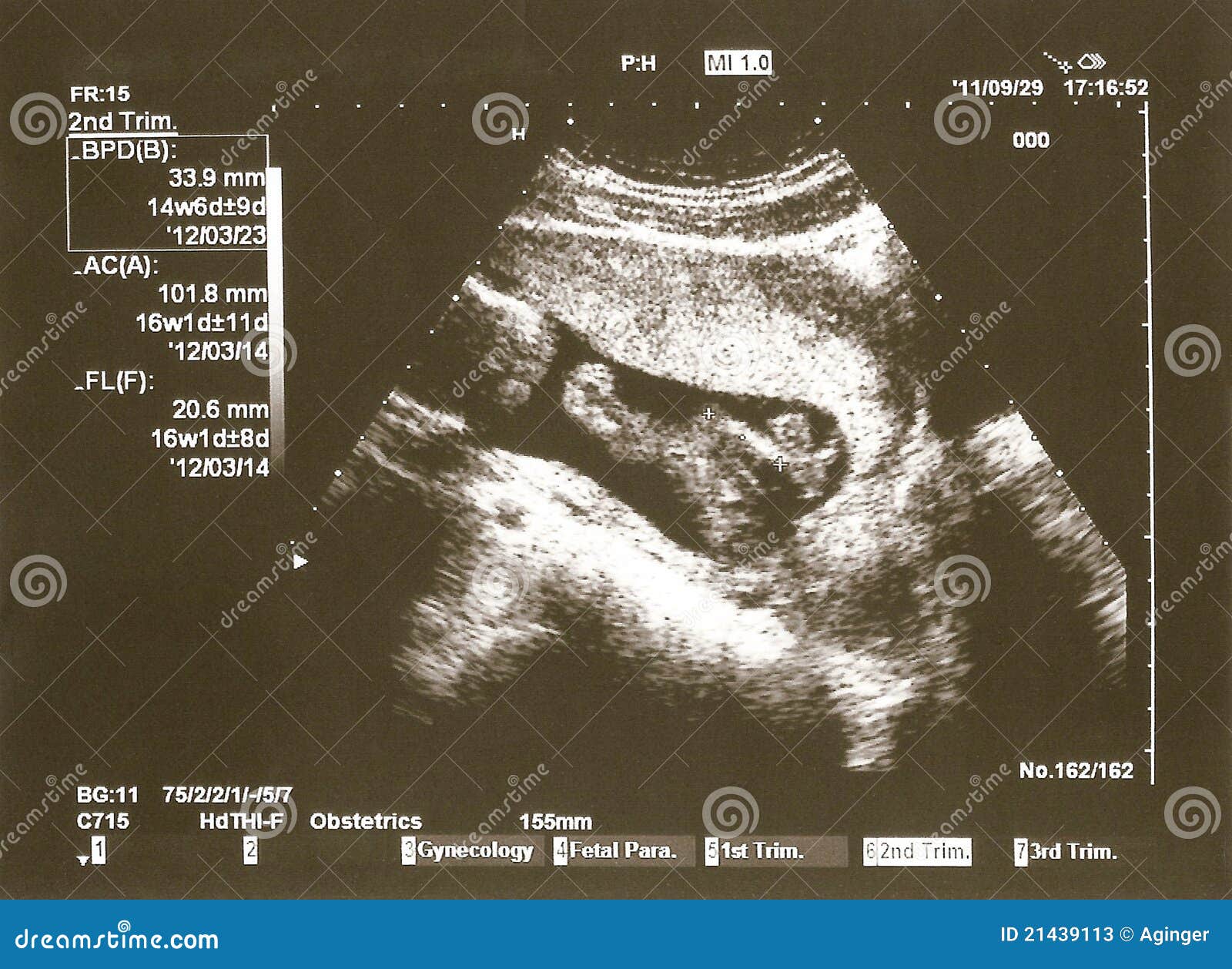 Ultrasound baby feet stock image. Image of close, baby - 21439113