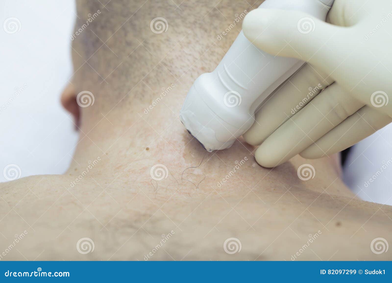 Ultrasound Examination of the Thyroid Gland Stock Image - Image of neck ...