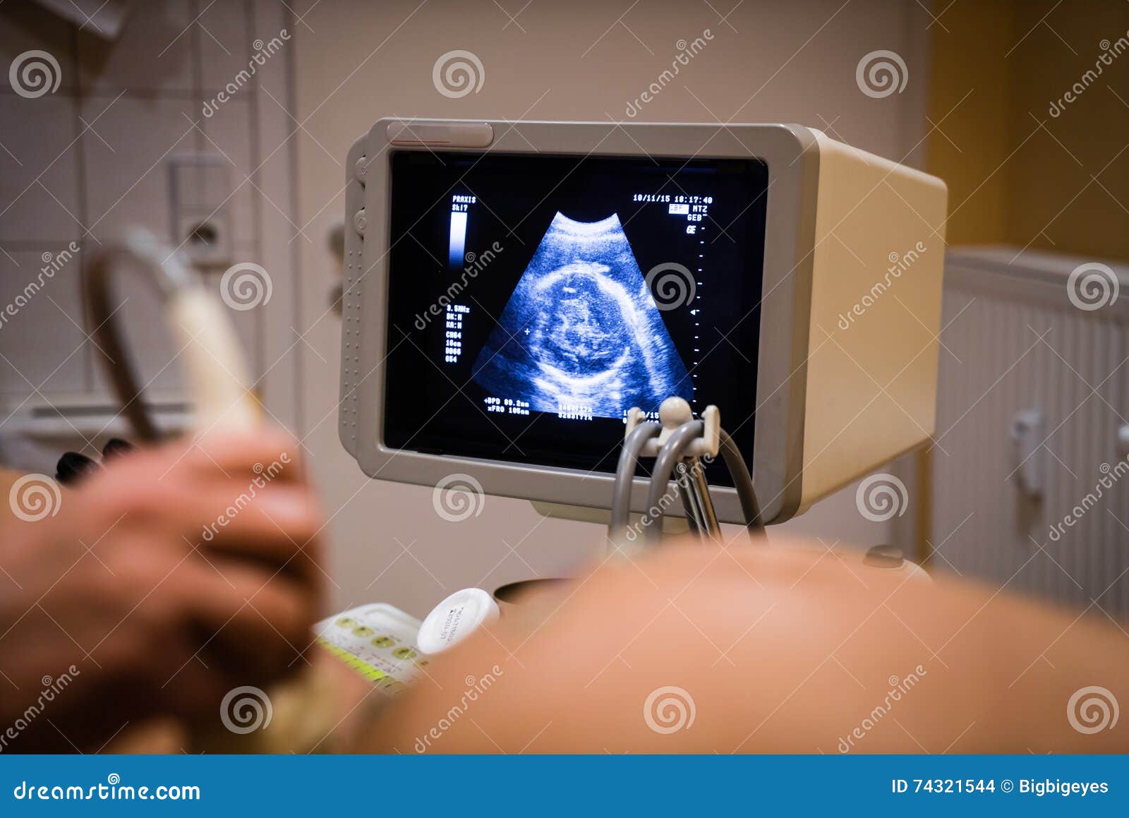 Ultrasound Image of a 30 Week Old Fetus Stock Photo - Image of person ...
