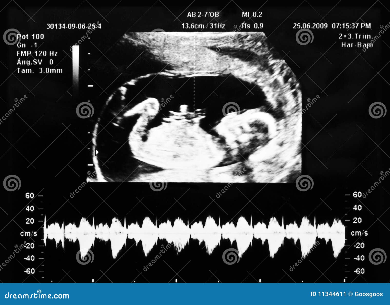 Ultrasound Scan Explanation. Doctor Interpreting Test Results To Female ...