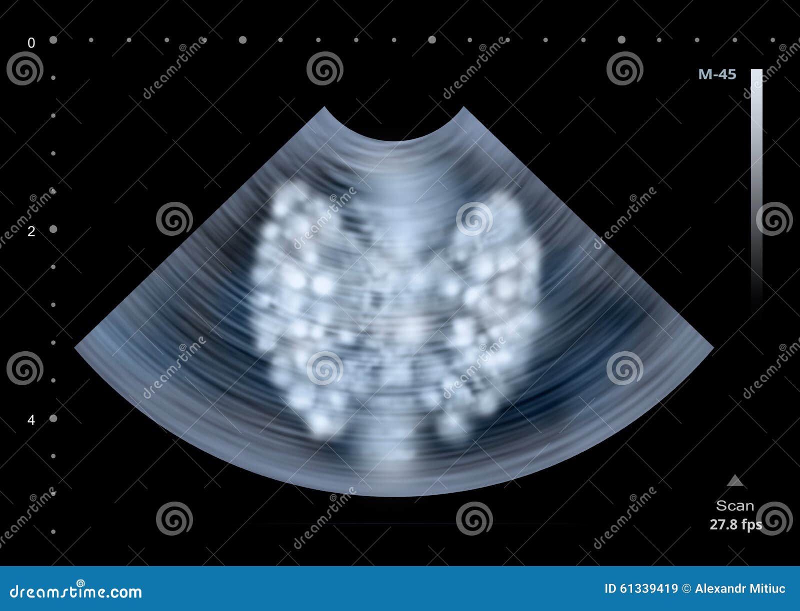 Ultrasound Scan of Human Thyroid Gland. Stock Illustration ...