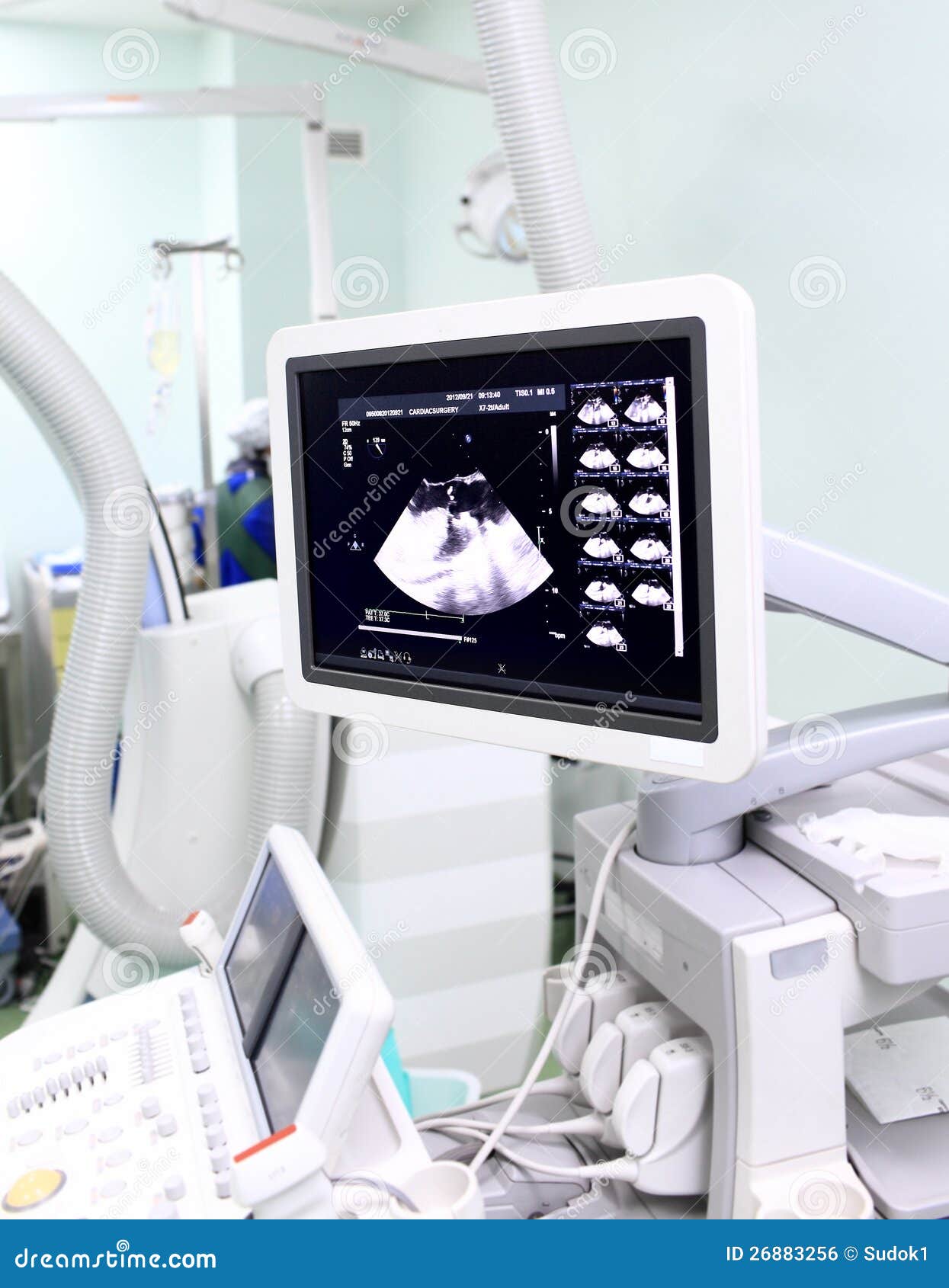 Ultrasound scanning stock photo. Image of hospital, computer - 26883256