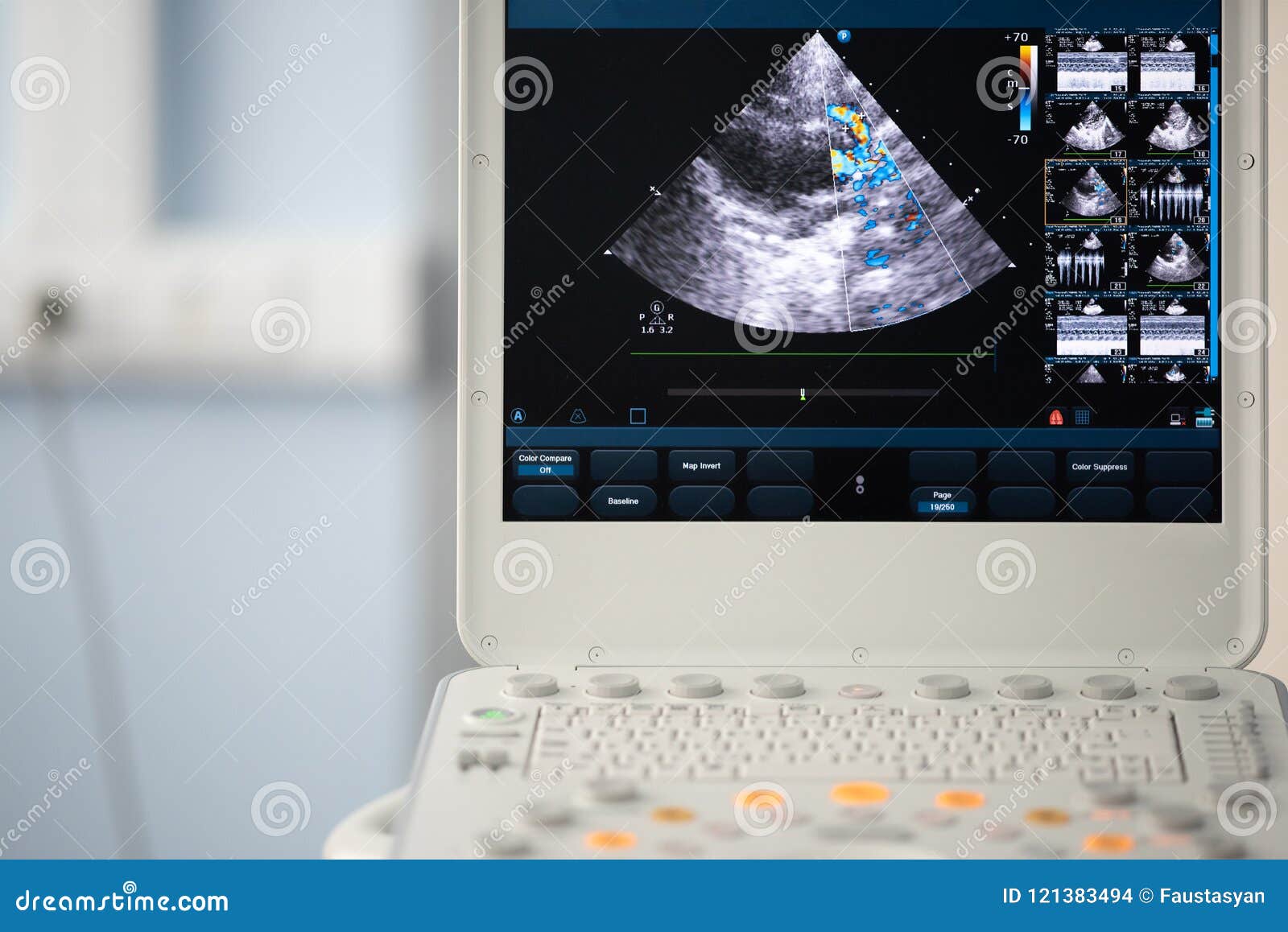 The Ultrasound Screen with the Image of a Heart Scan with a Doppler ...