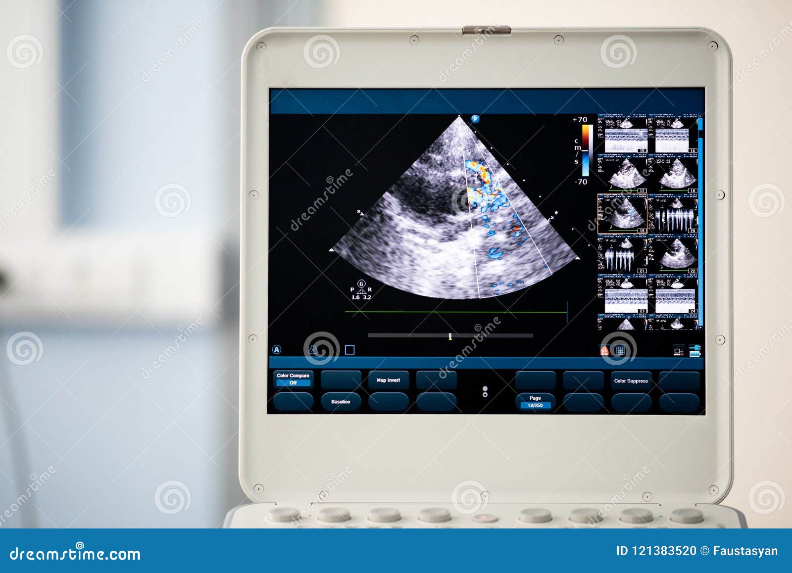 The Ultrasound Screen with the Image of a Heart Scan with a Doppler ...