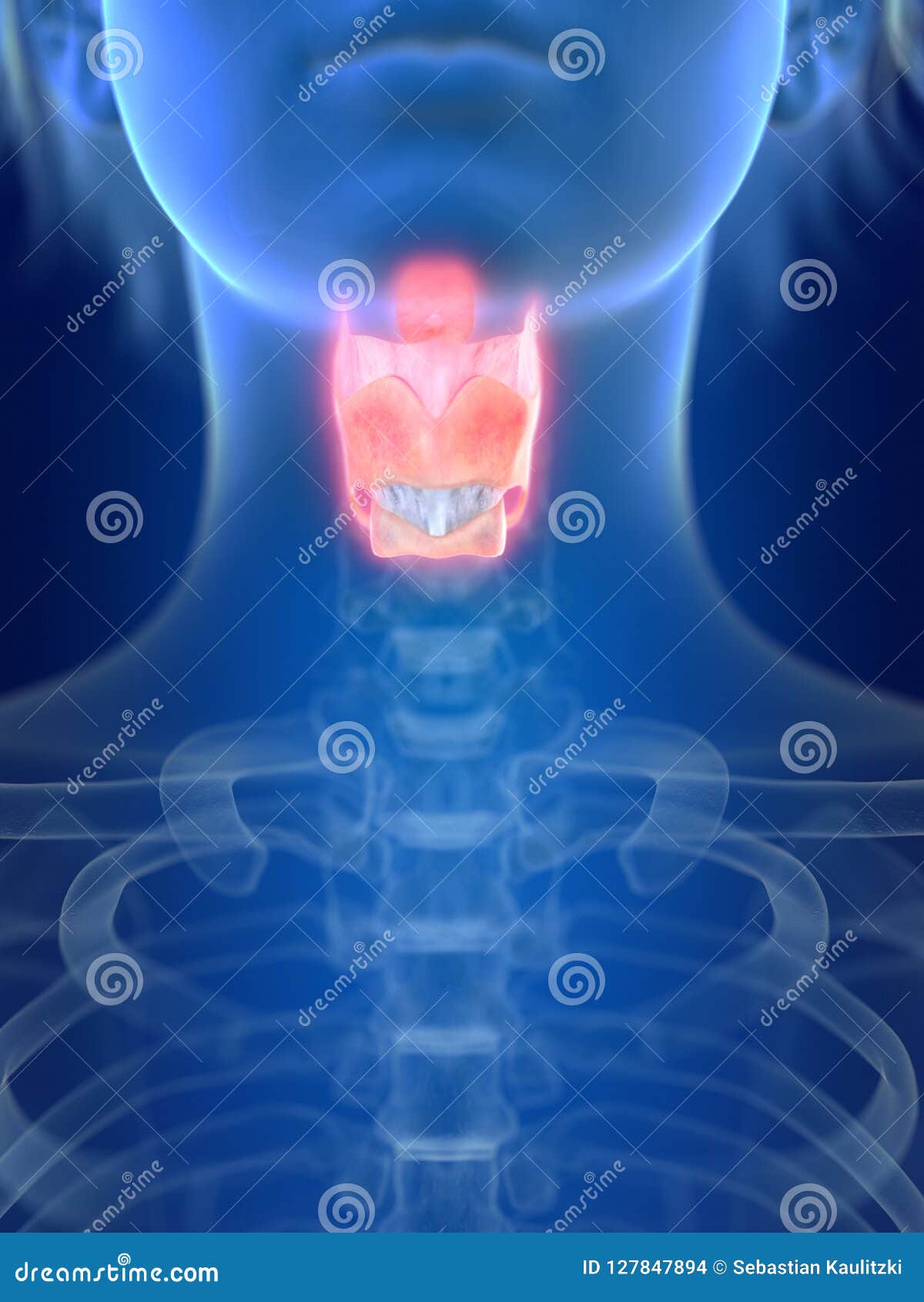 Uma laringe inflamada ilustração stock. Ilustração de interior - 127847894