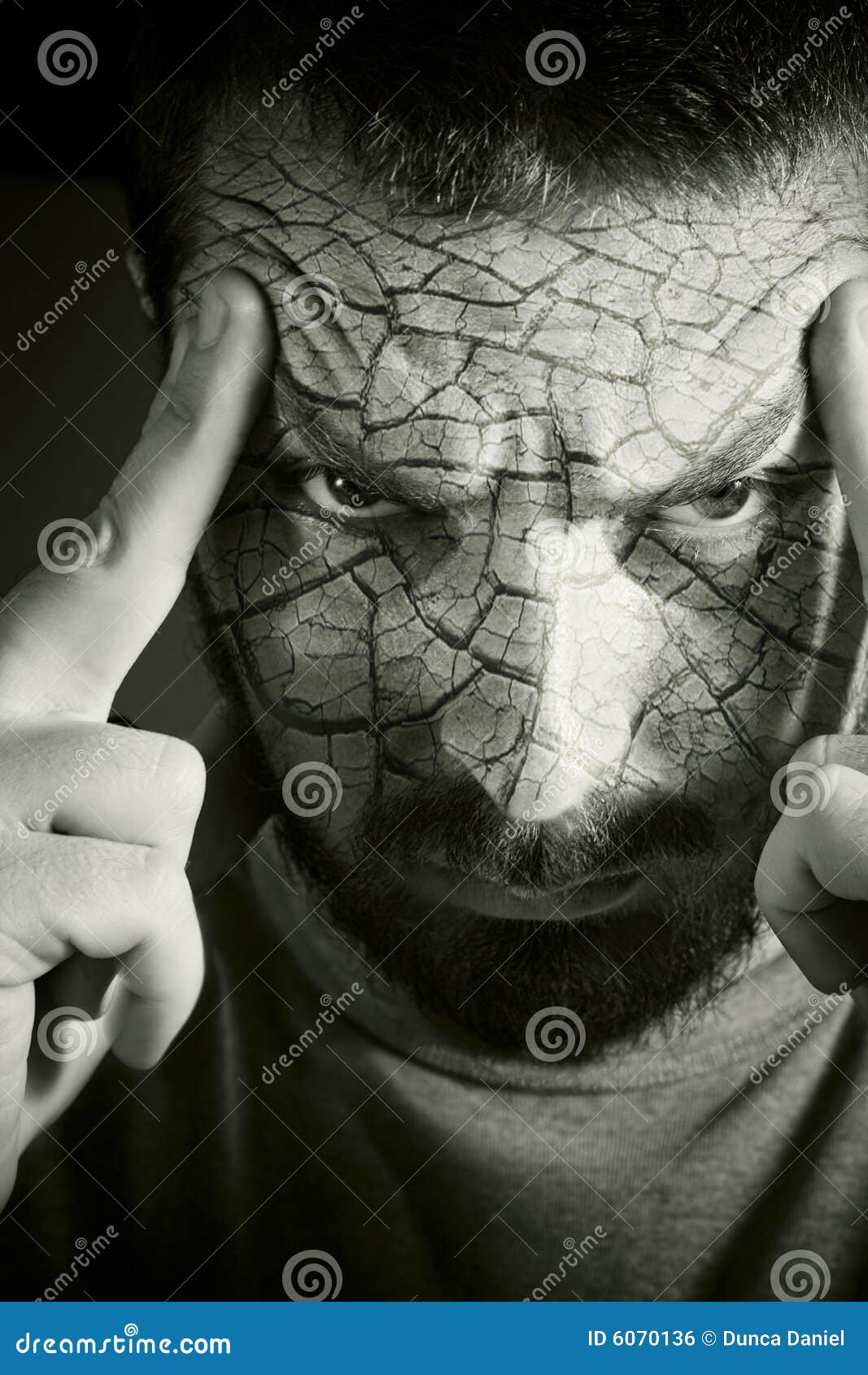 Umgekippter Mann Mit Gebrochener Haut Stockfoto - Bild von kaukasisch ...