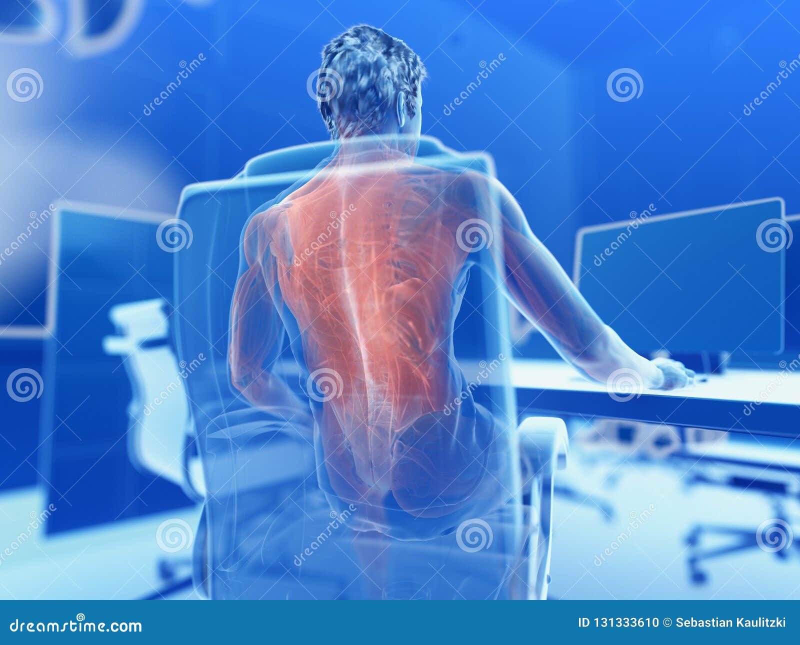 Un PC - muscles douloureux illustration stock. Illustration du maintien ...