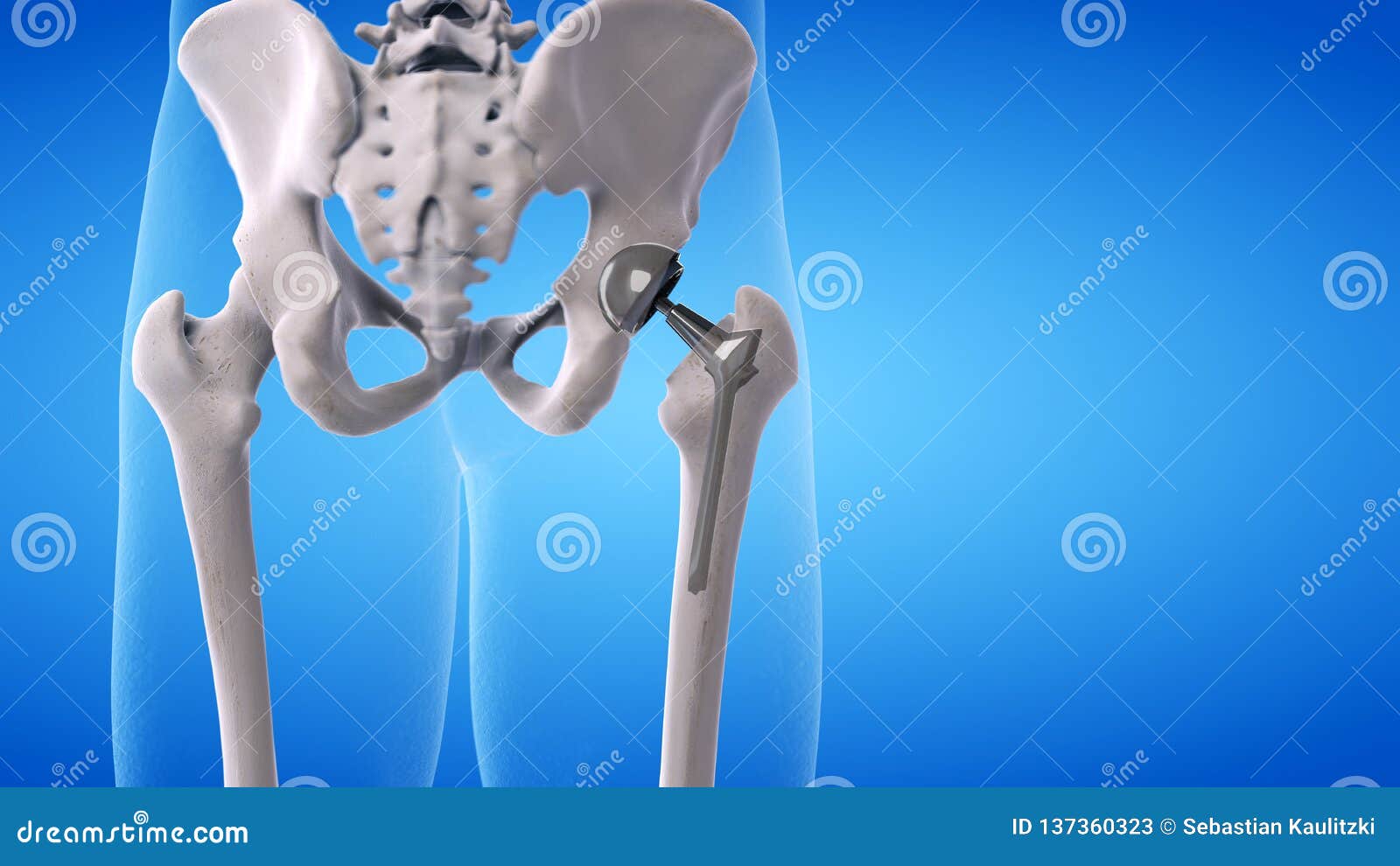 Cadera Ilustraciones Stock, Vectores, Y Clipart – (32,002 Ilustraciones ...