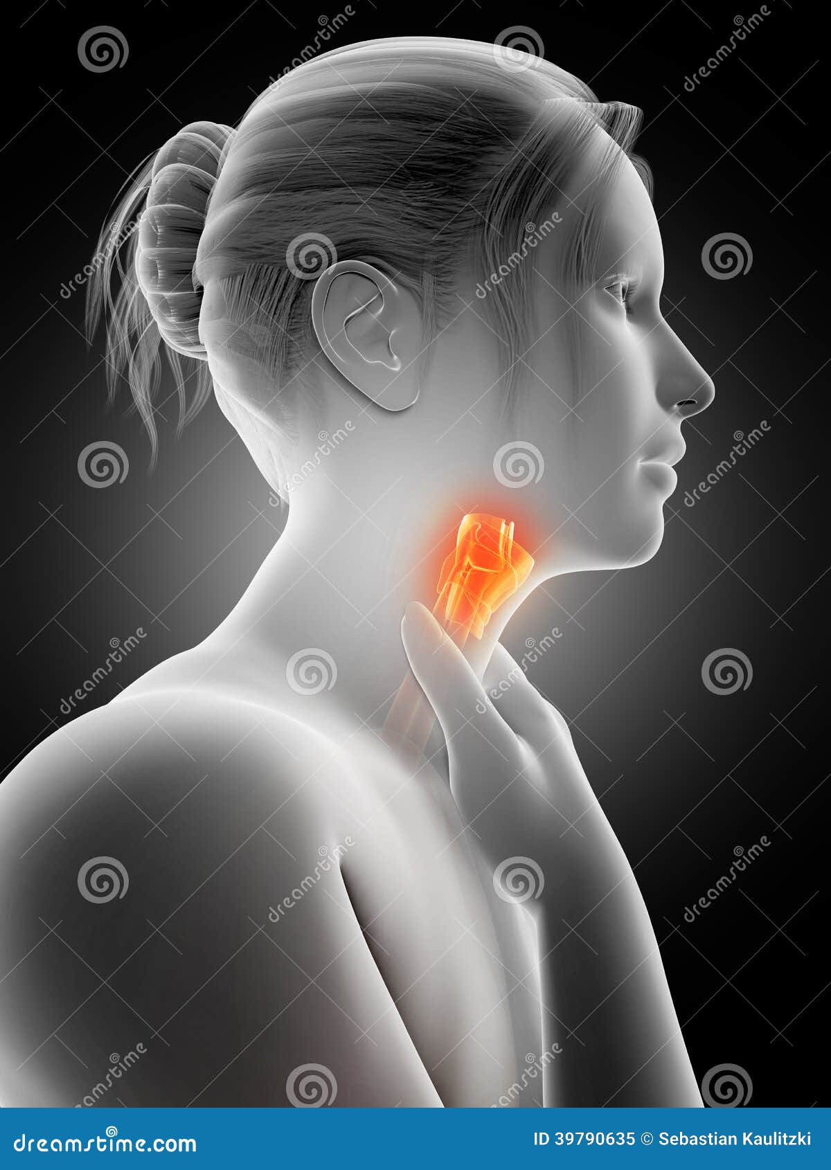 Una laringe infiammata illustrazione di stock. Illustrazione di donna ...