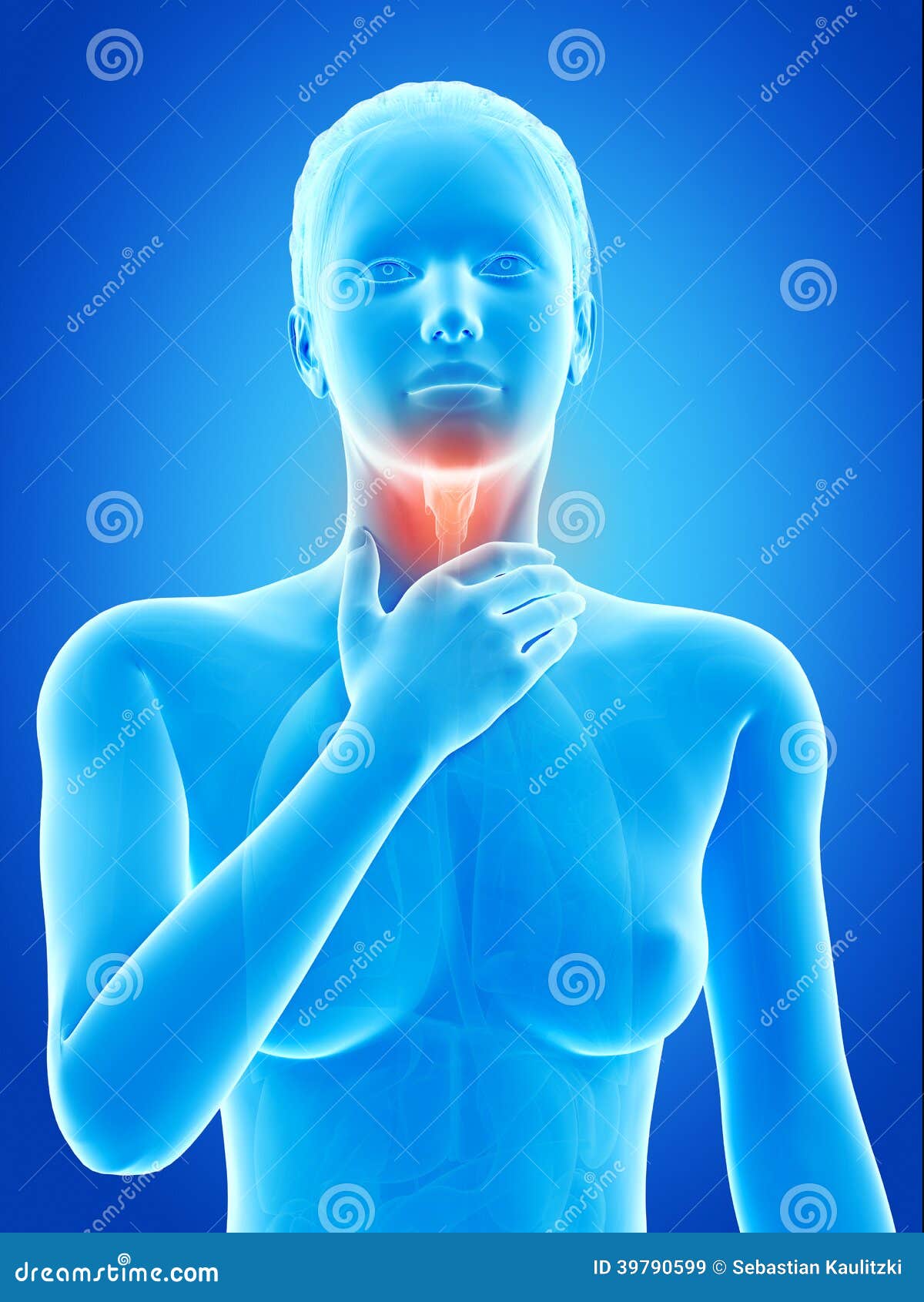 Una laringe inflamada stock de ilustración. Ilustración de enfermo ...