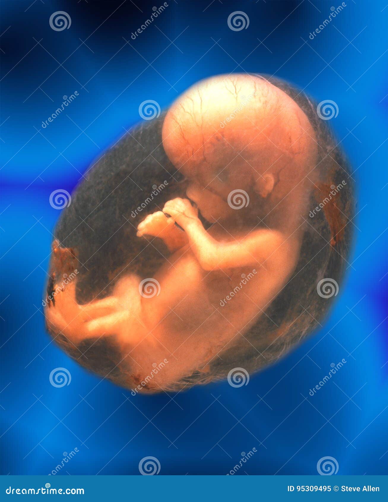 Human Fetus Model With Stethoscope Royalty-Free Stock Image ...