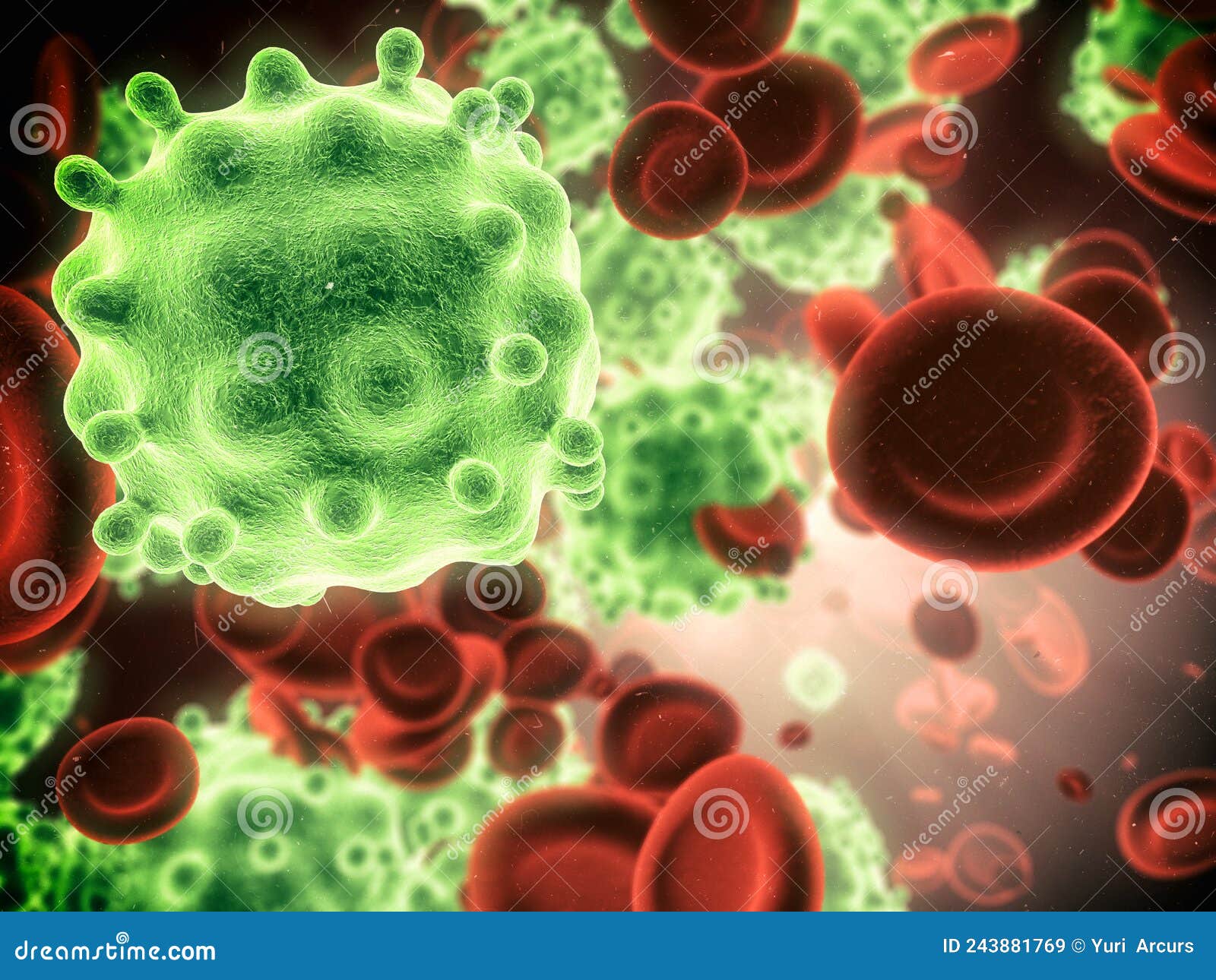 Under Attack. Microscopic View of Bacteria Attacking Healthy Cells in ...