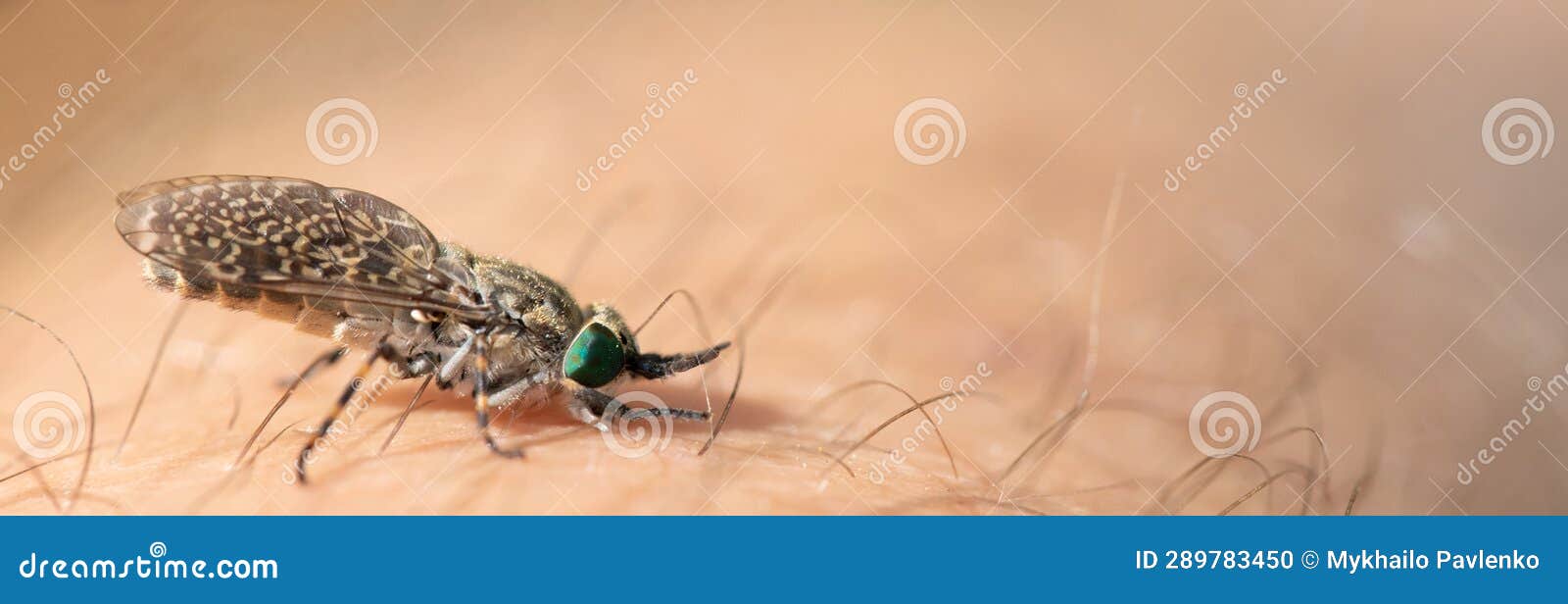 Under the Microscope: Analyzing an Insect S Bite on Skin Stock Photo ...