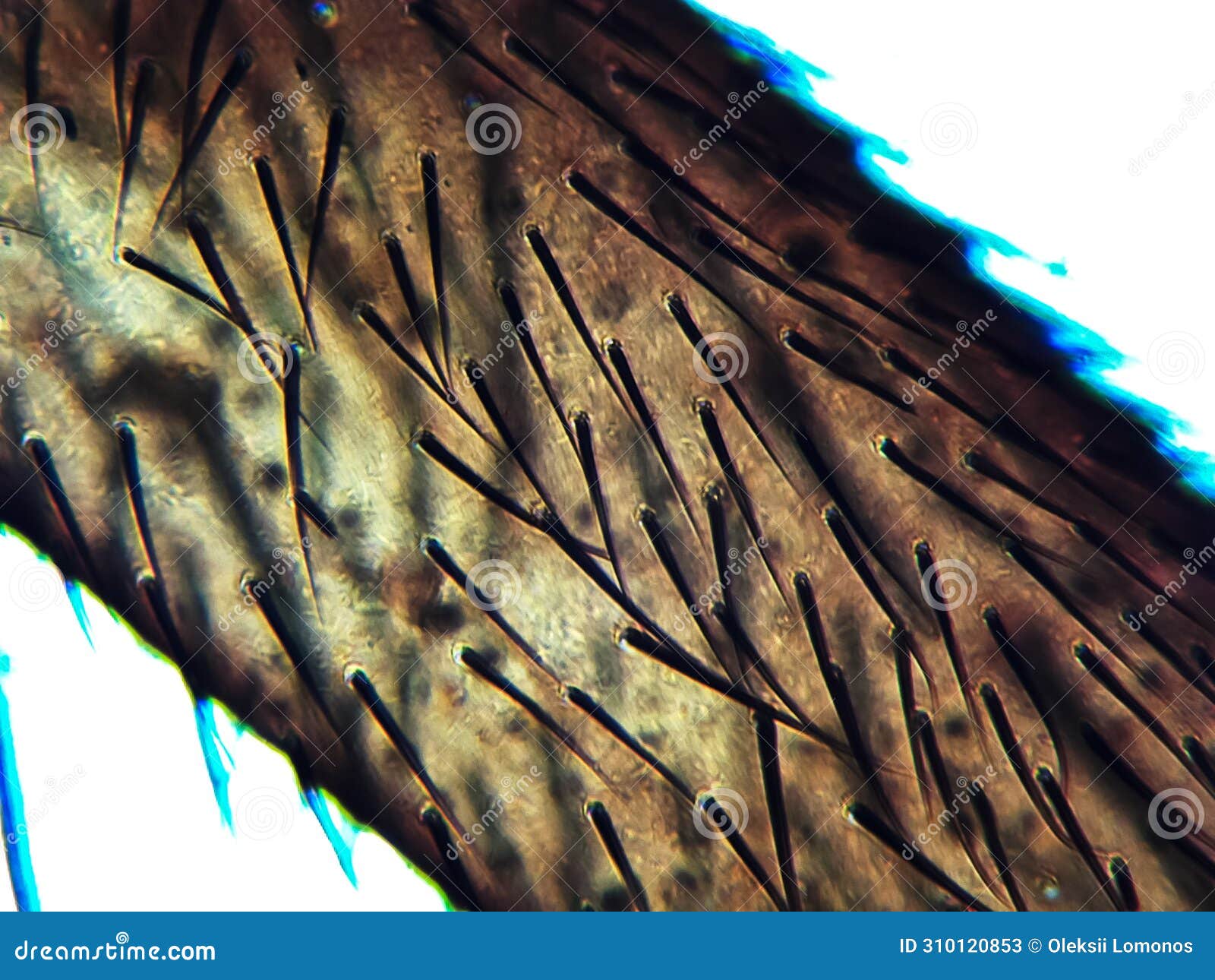 Under the Microscope, the Leg of a Fly Becomes a Marvel of Intricate ...