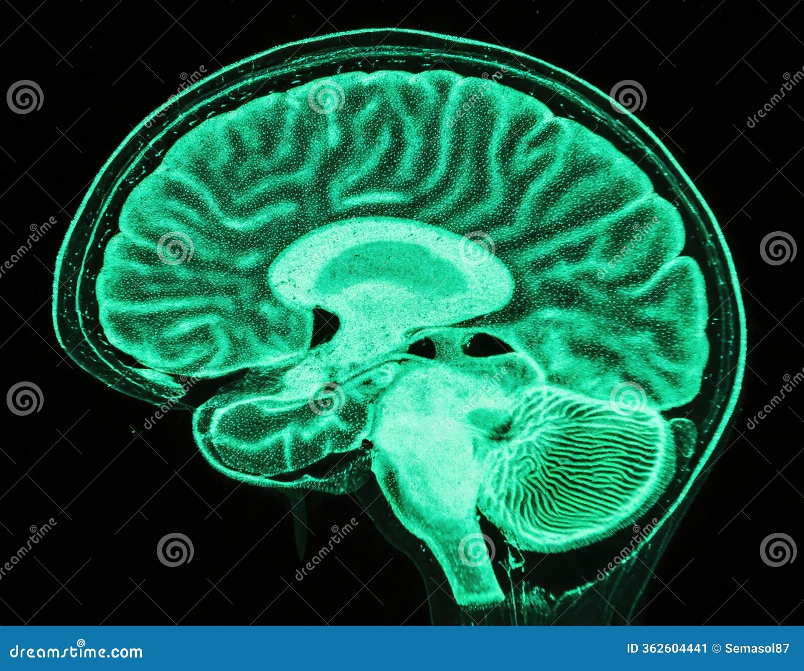 Understanding Brain Tomography Structure through Detailed Imaging ...