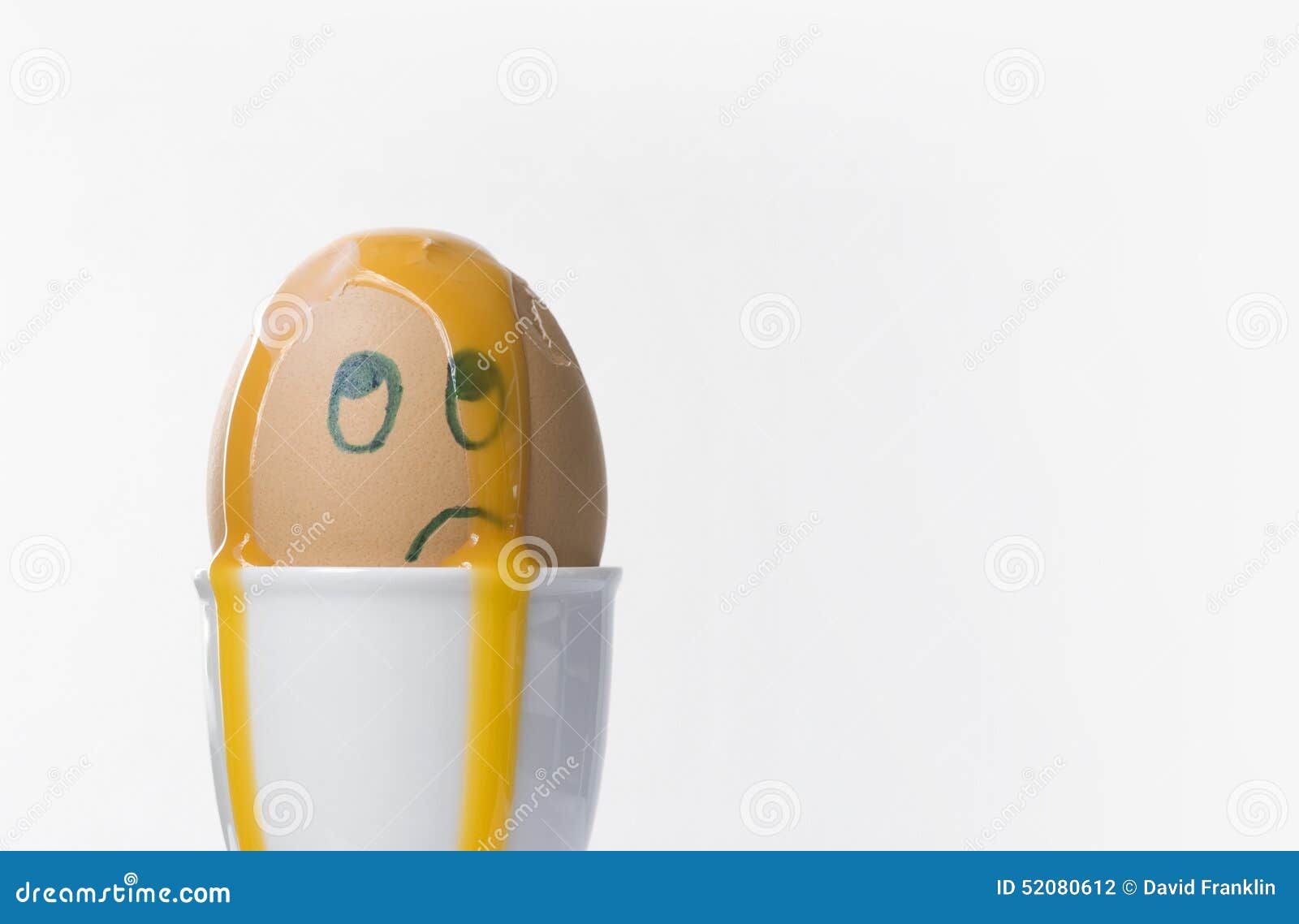 Boiled Egg in Egg Cup with Unhappy Face and Runny Yolk Stock Photo ...