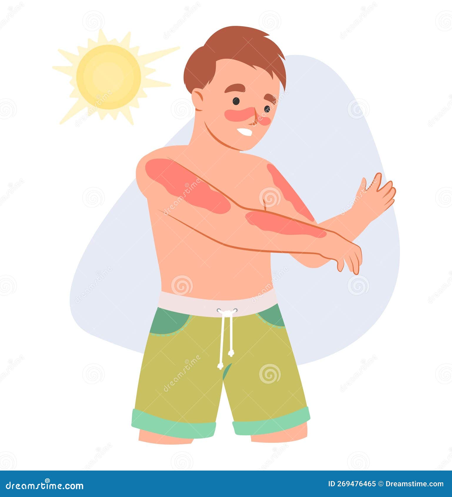 Hot Weather Man Got Sunburn In Very Hot Summer Days Vector