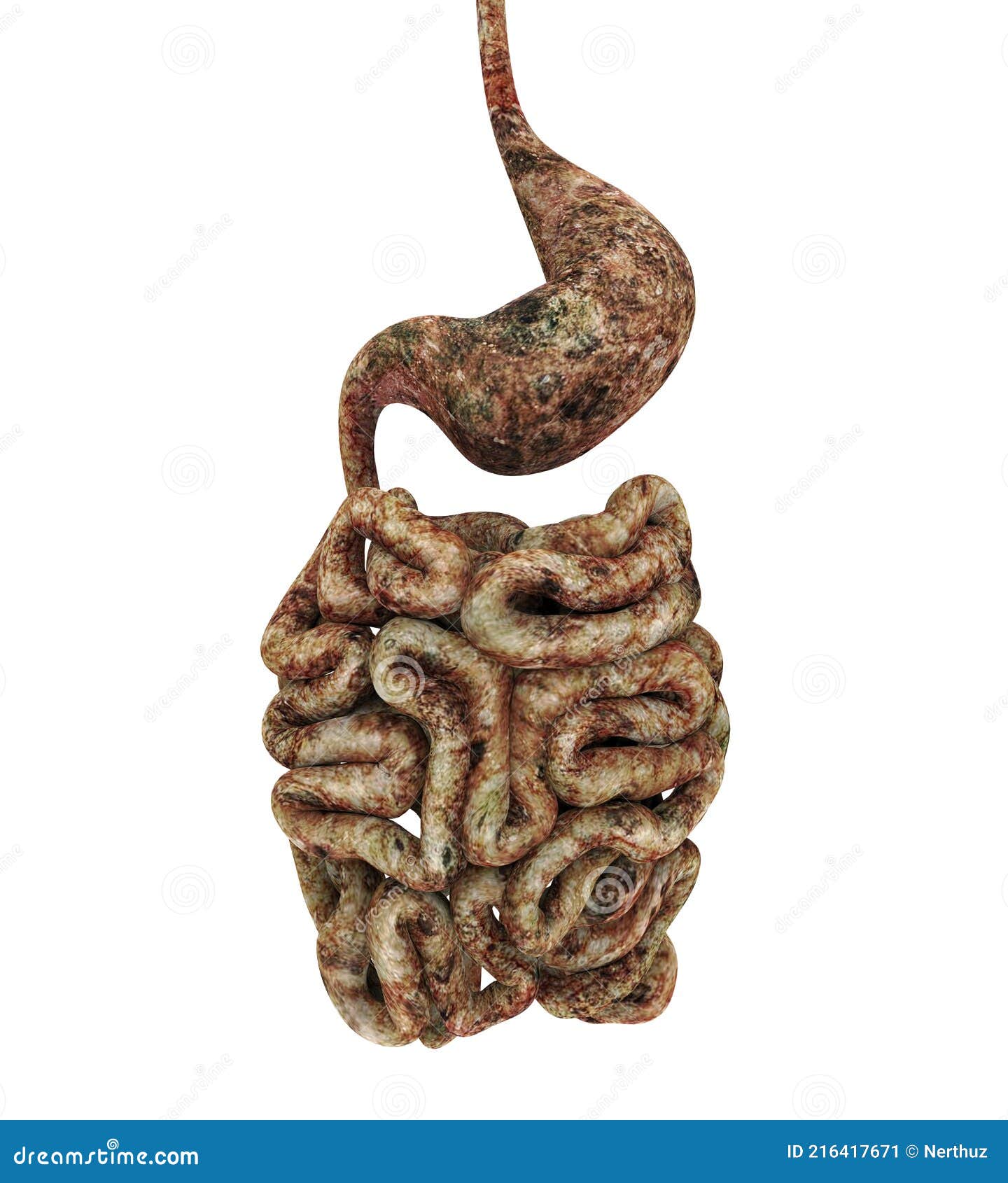 Unhealthy Human Digestive System Illustration Stock Illustration ...