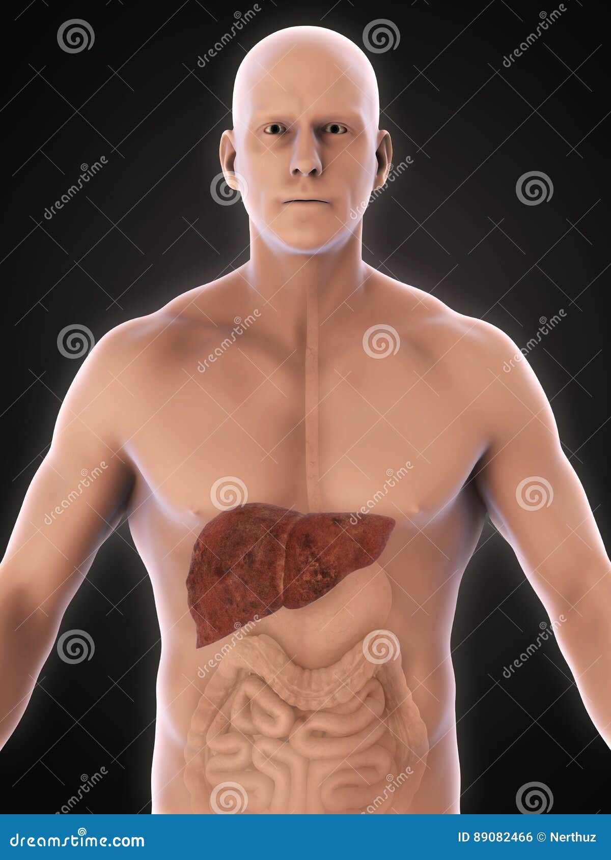 Unhealthy Liver Anatomy stock illustration. Illustration of cirrhosis ...