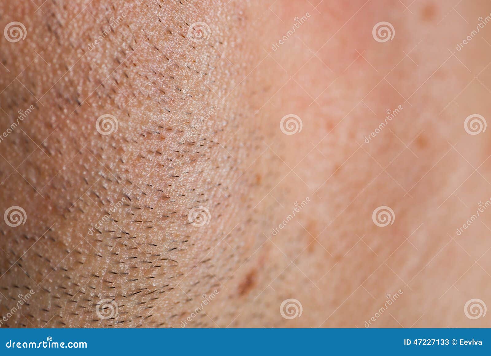 Unshaved Skin. Royalty-Free Stock Photography | CartoonDealer.com #47227133
