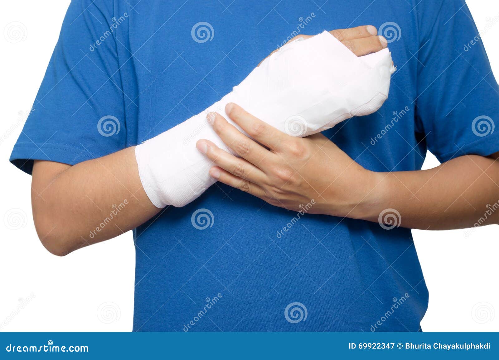 Uomini Con Il Suo Braccio Destro Rotto Immagine Stock - Immagine di ...