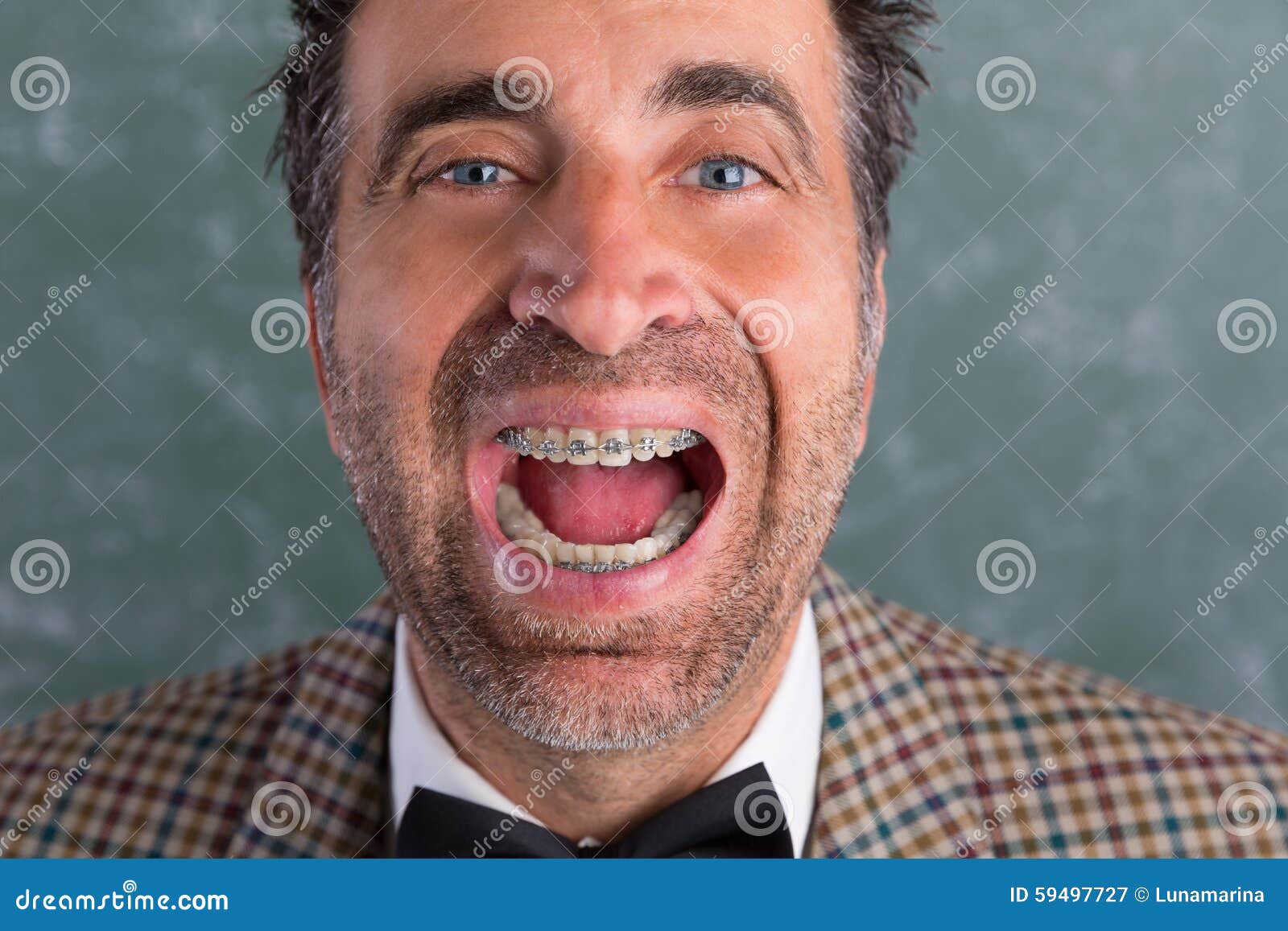 Uomo Sciocco Del Nerd Retro Con L'espressione Divertente Dei Ganci ...