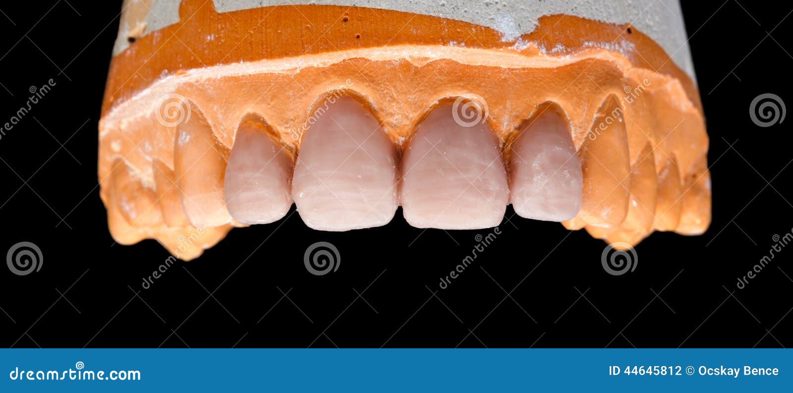 Denture Gypsum Print Plaster Teeth Model Isolated On White Background ...