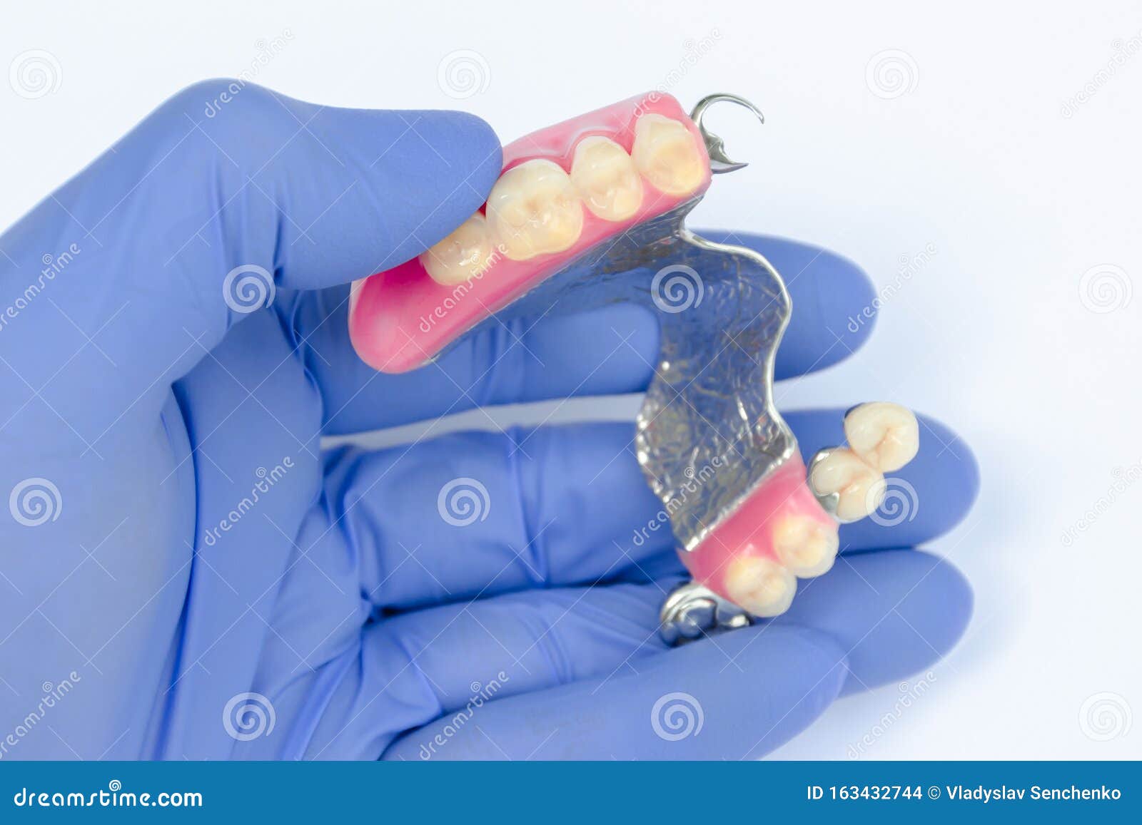 Upper Denture in the Hands of a Dentist. Blue Glove. Clasp Prosthesis ...