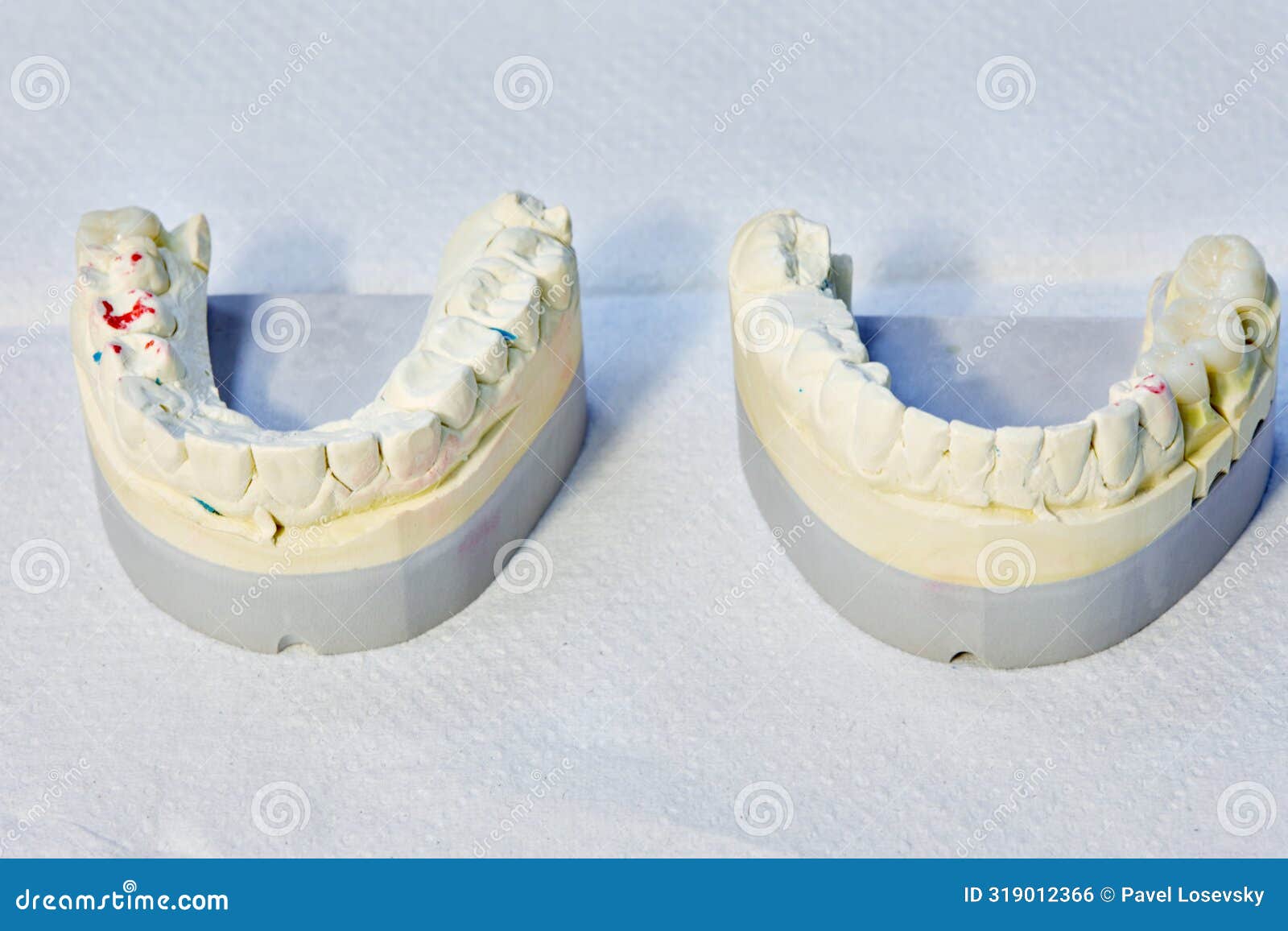 Upper and Lower Artificial Jaws with Colour Marks Stock Photo - Image ...