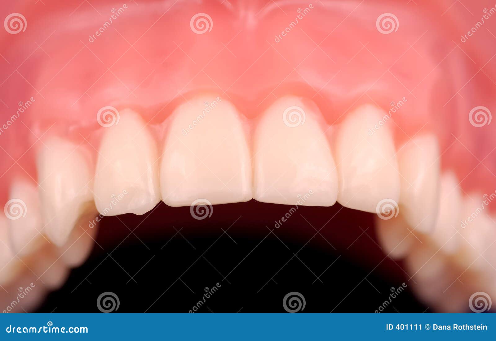 Upper Teeth stock image. Image of medical, enamel, clean - 401111