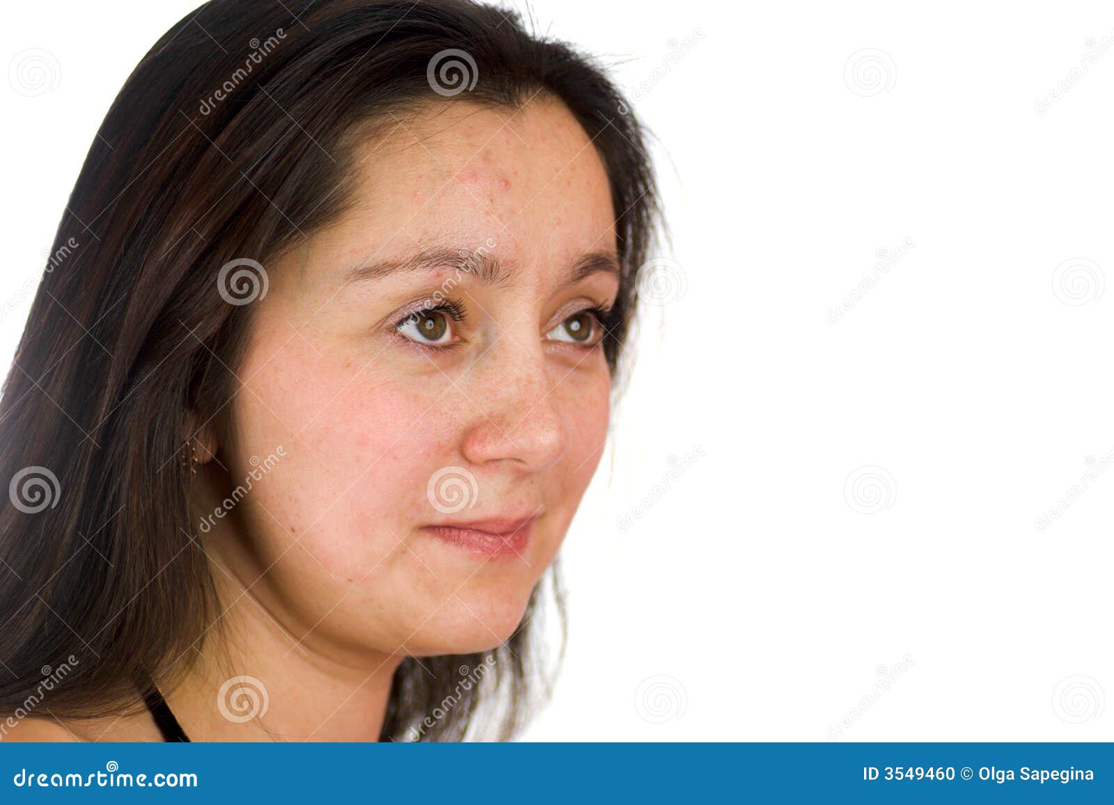 Upset woman with acne stock photo. Image of facial, health - 3549460