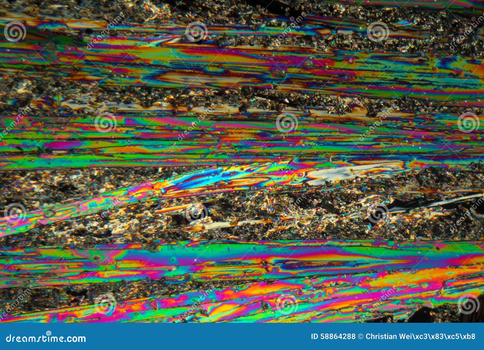 Urea Crystals Under the Microscope. Stock Photo - Image of health ...