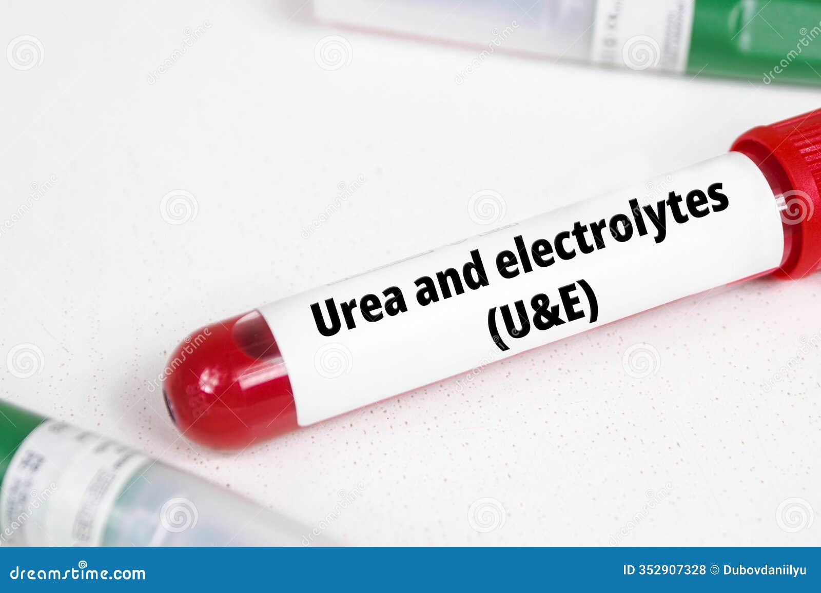 Urea and Electrolytes (U&E) Title Text of Medical Analysis Stock Photo ...