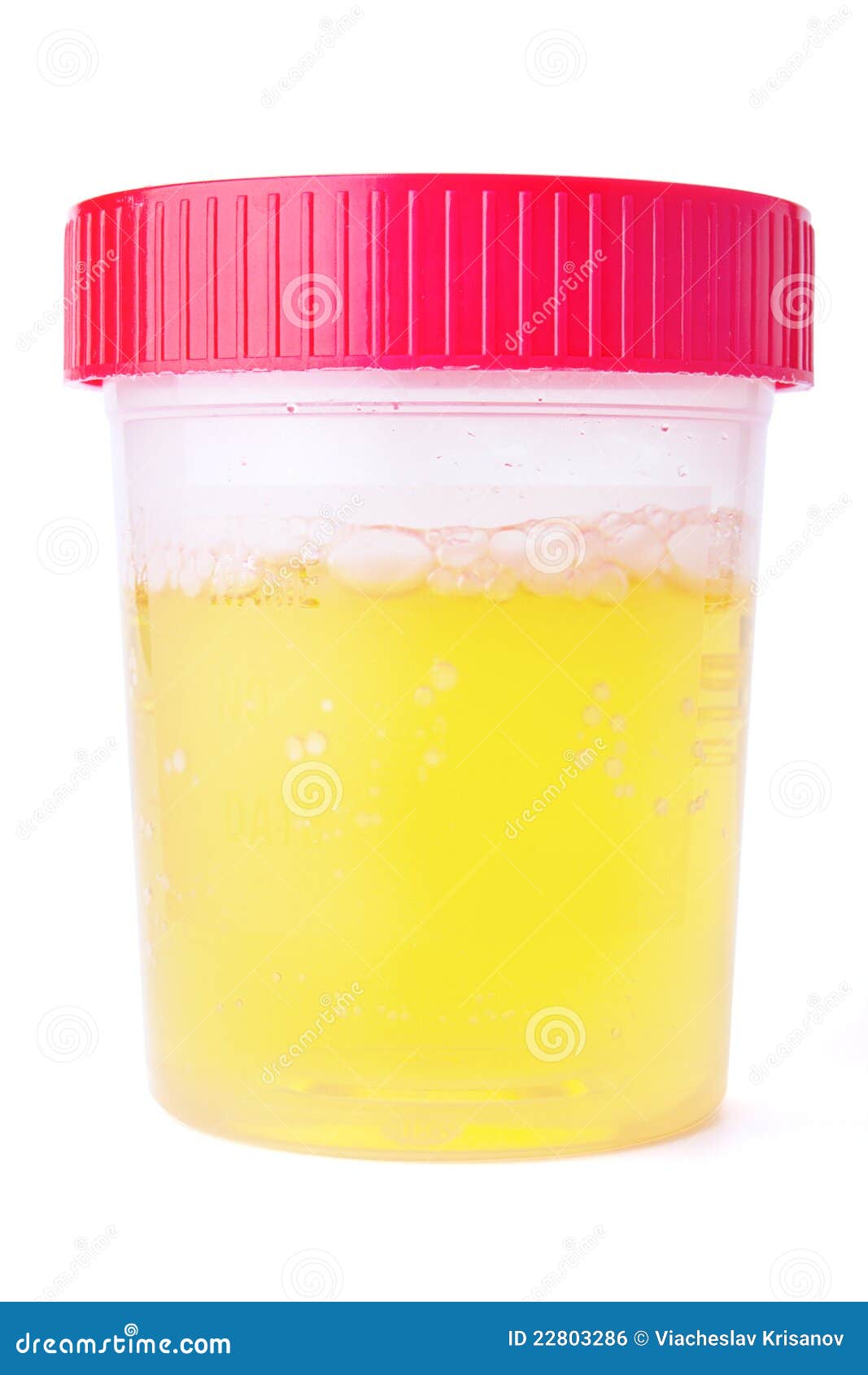 Urin-Probe stockfoto. Bild von medizinisch, hygiene, probenmaterial ...